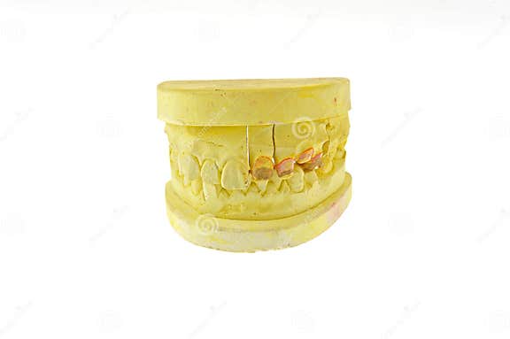 The tooth mold stock image. Image of false, laboratory - 309580903