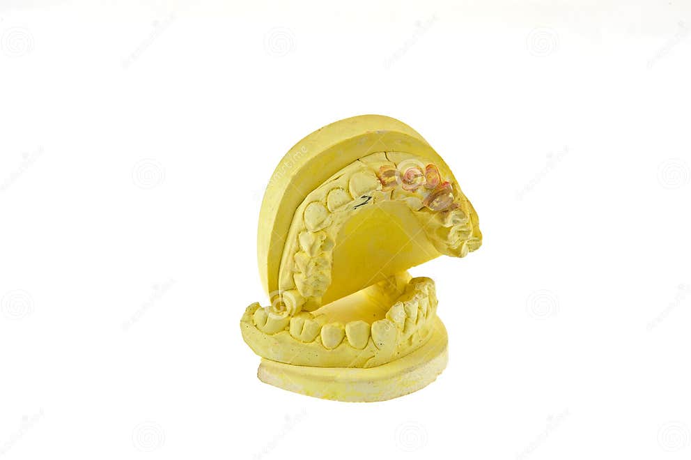 The tooth mold stock photo. Image of repair, false, dental - 309580930