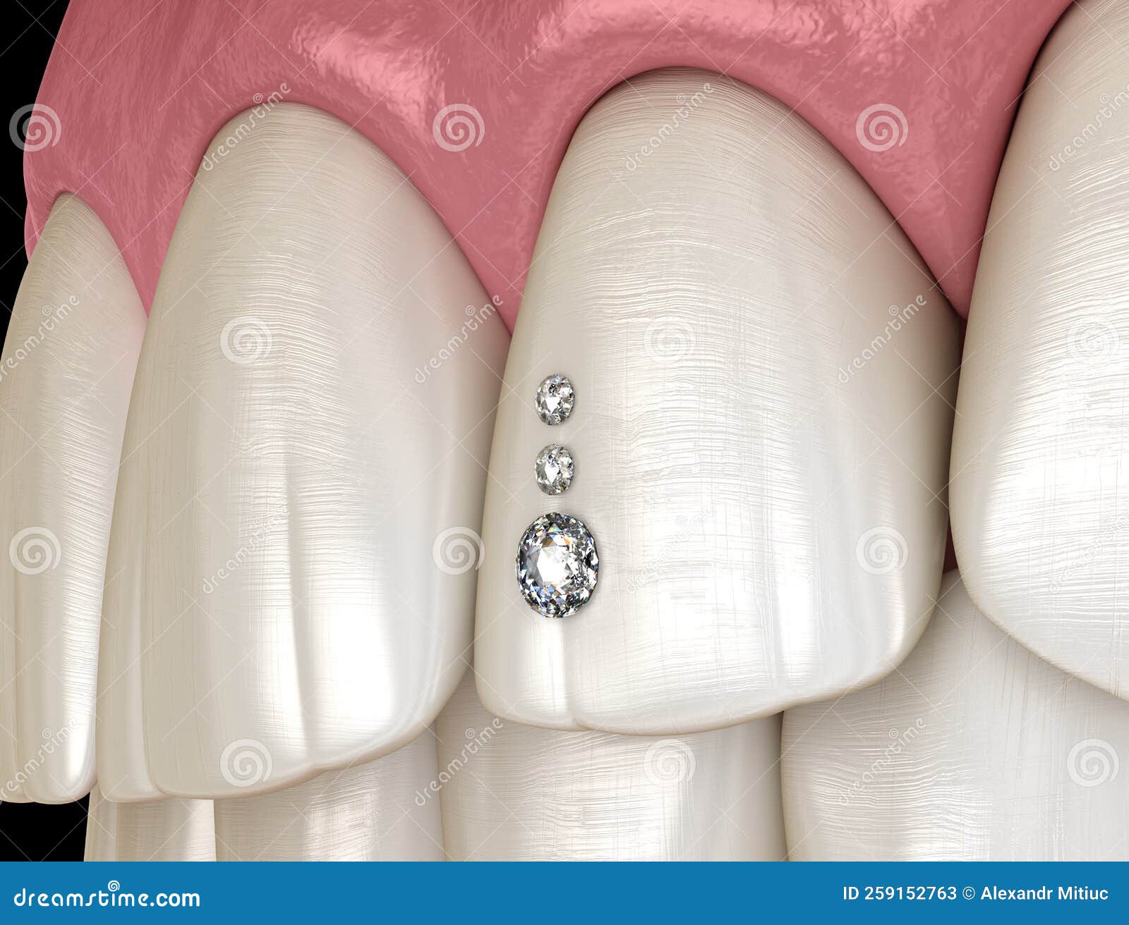 Tooth Piercing by Diamond, 3D Illustration Concept Stock Illustration ...