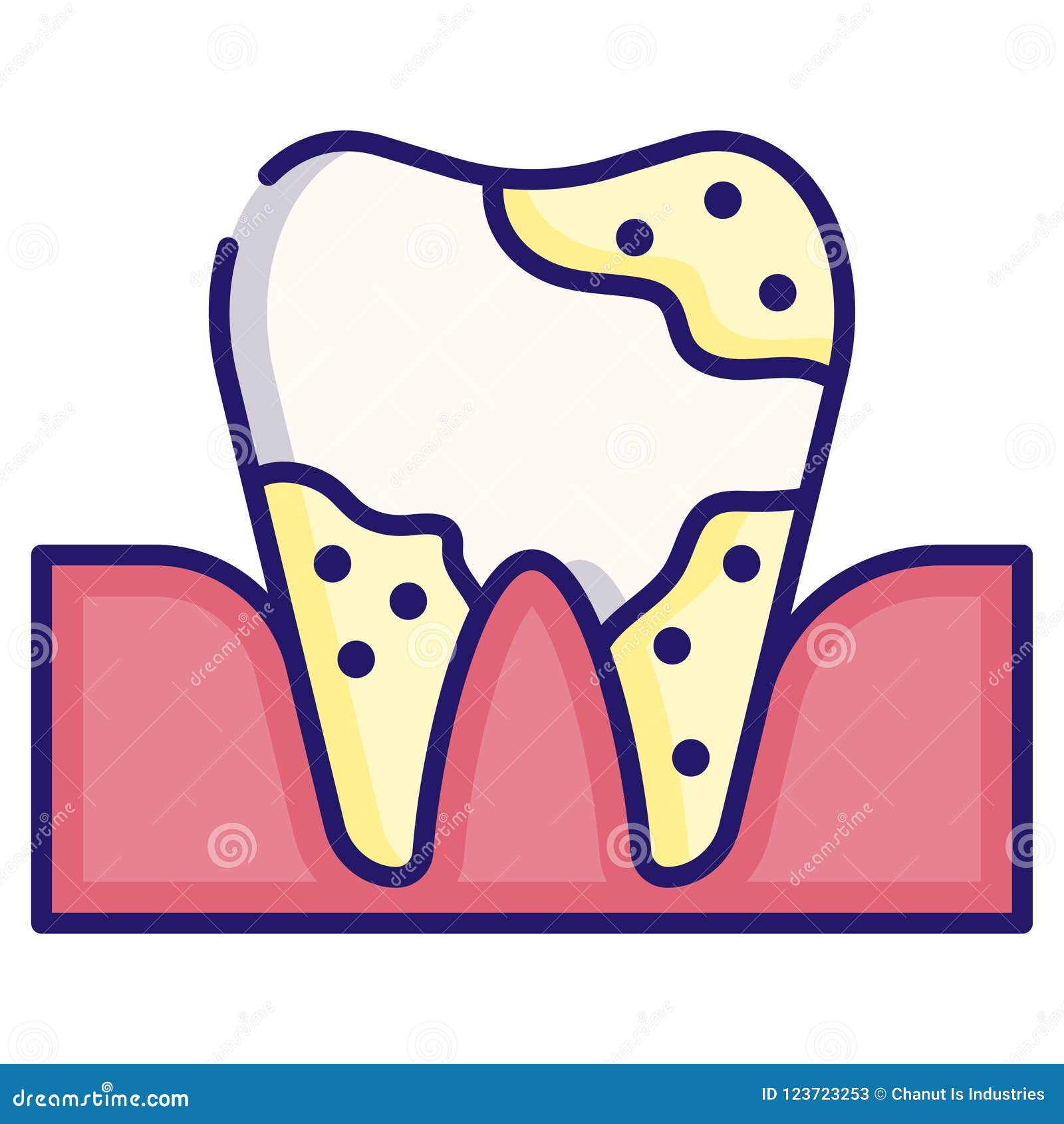 Tooth Plaque LineColor Cartoon Vector | CartoonDealer.com #123723253