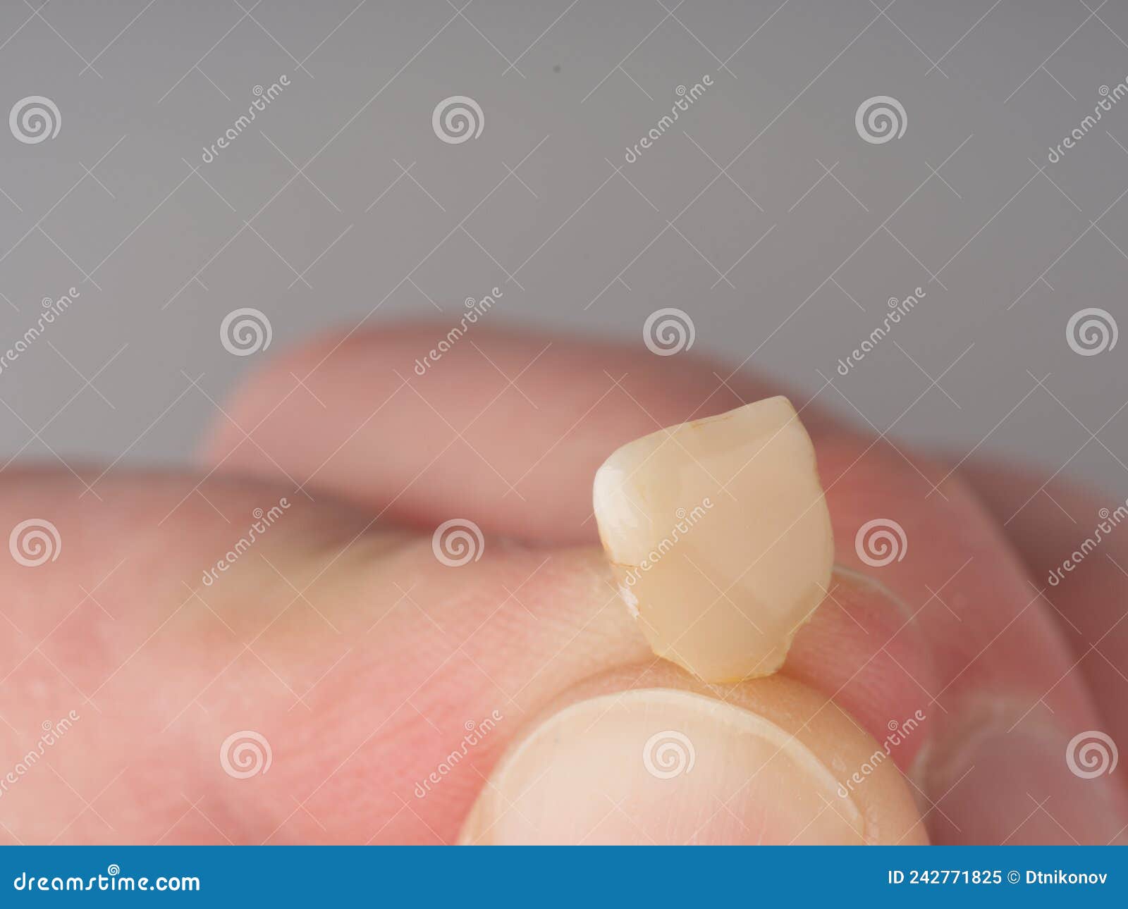 A Tooth Pulled Out in His Hand. Closeup Stock Image - Image of hand ...
