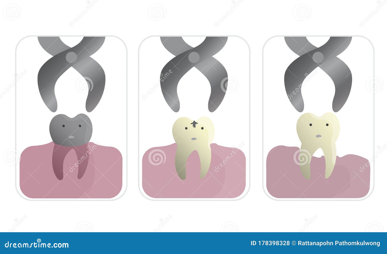 Tooth Removal Curing Tooth Disease Stock Vector - Illustration of ...
