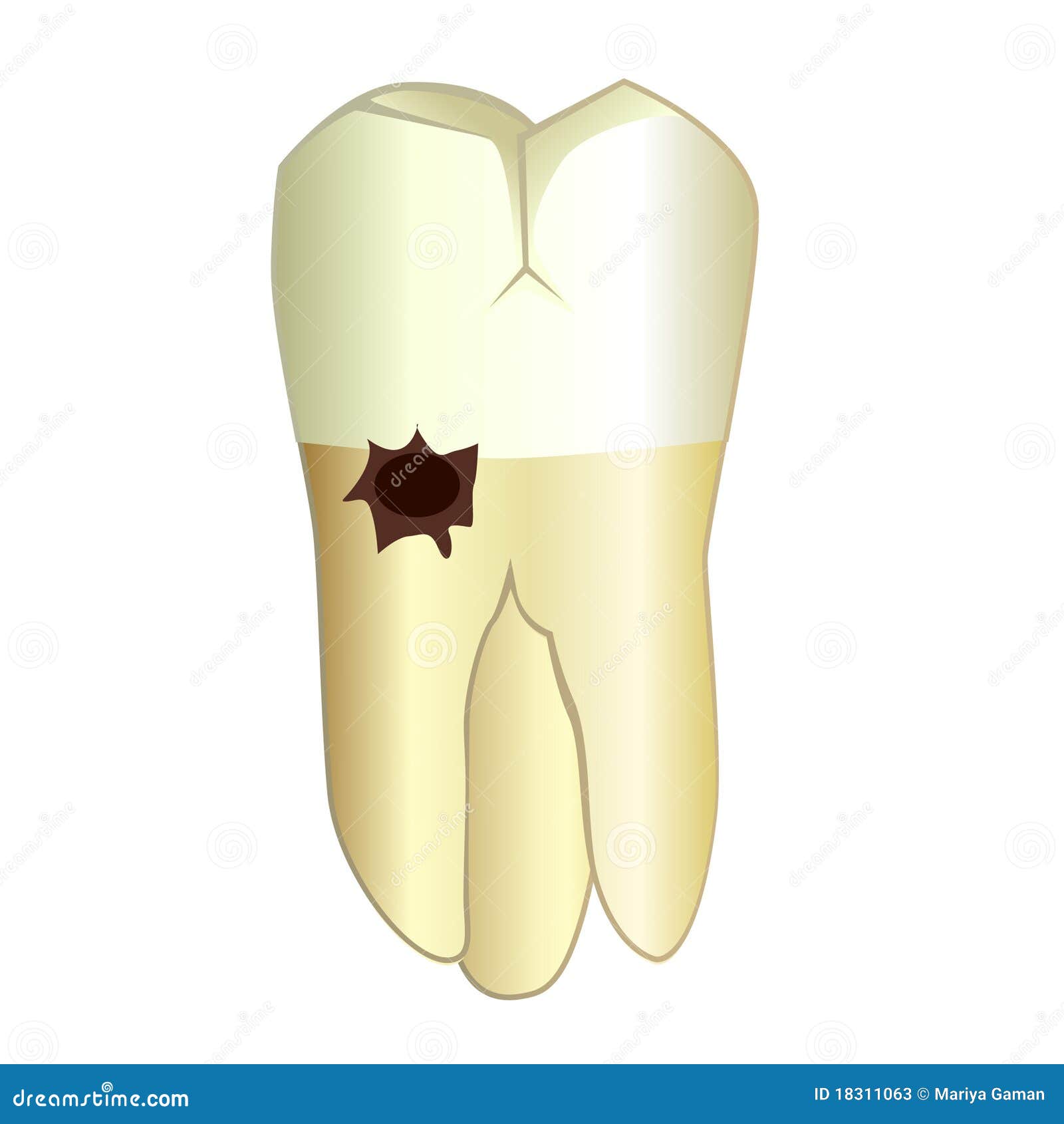 Tooth with a root stock vector. Illustration of medicine - 18311063