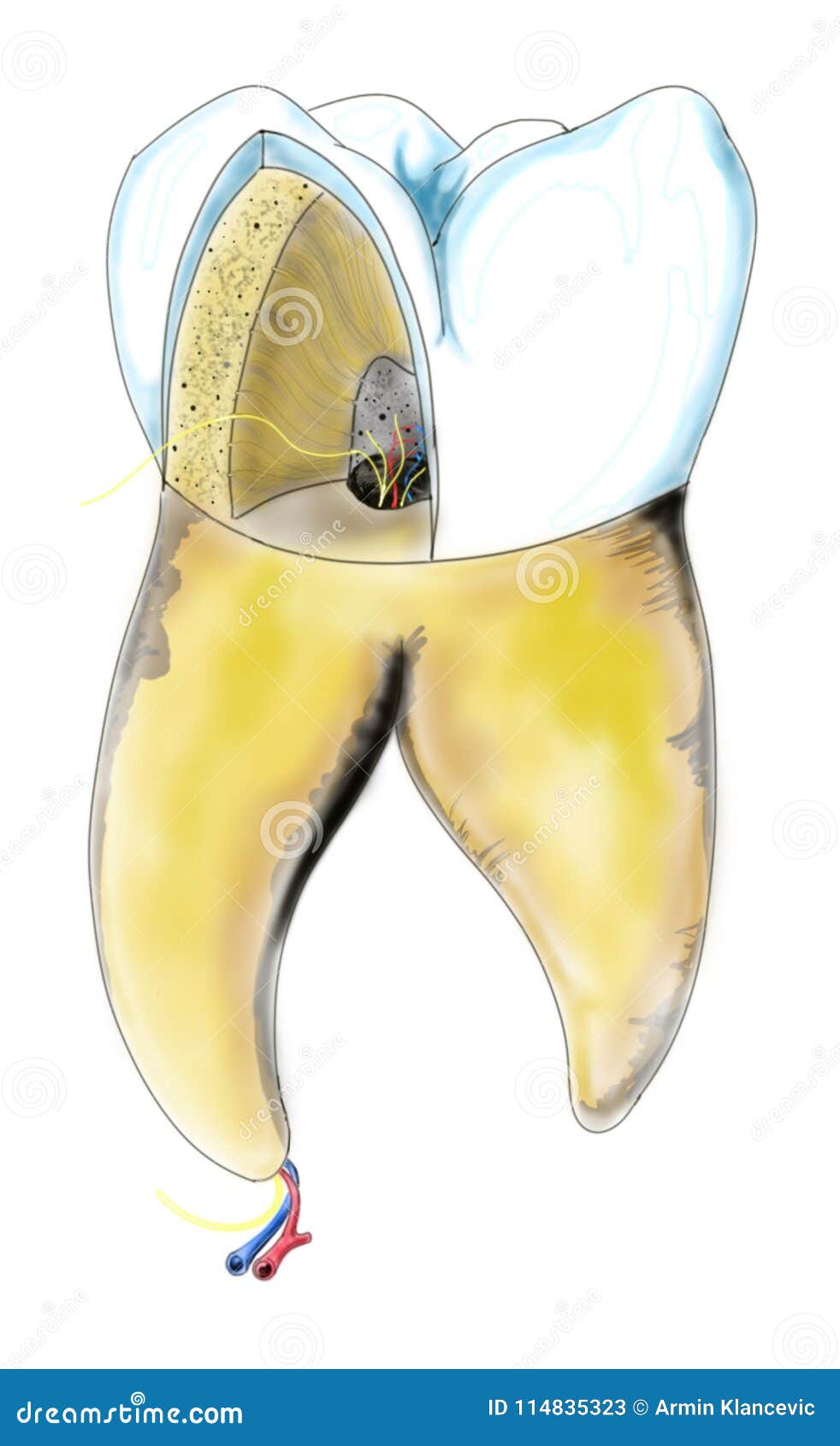 Tooth Transversal Intersection Stock Illustration - Illustration of ...