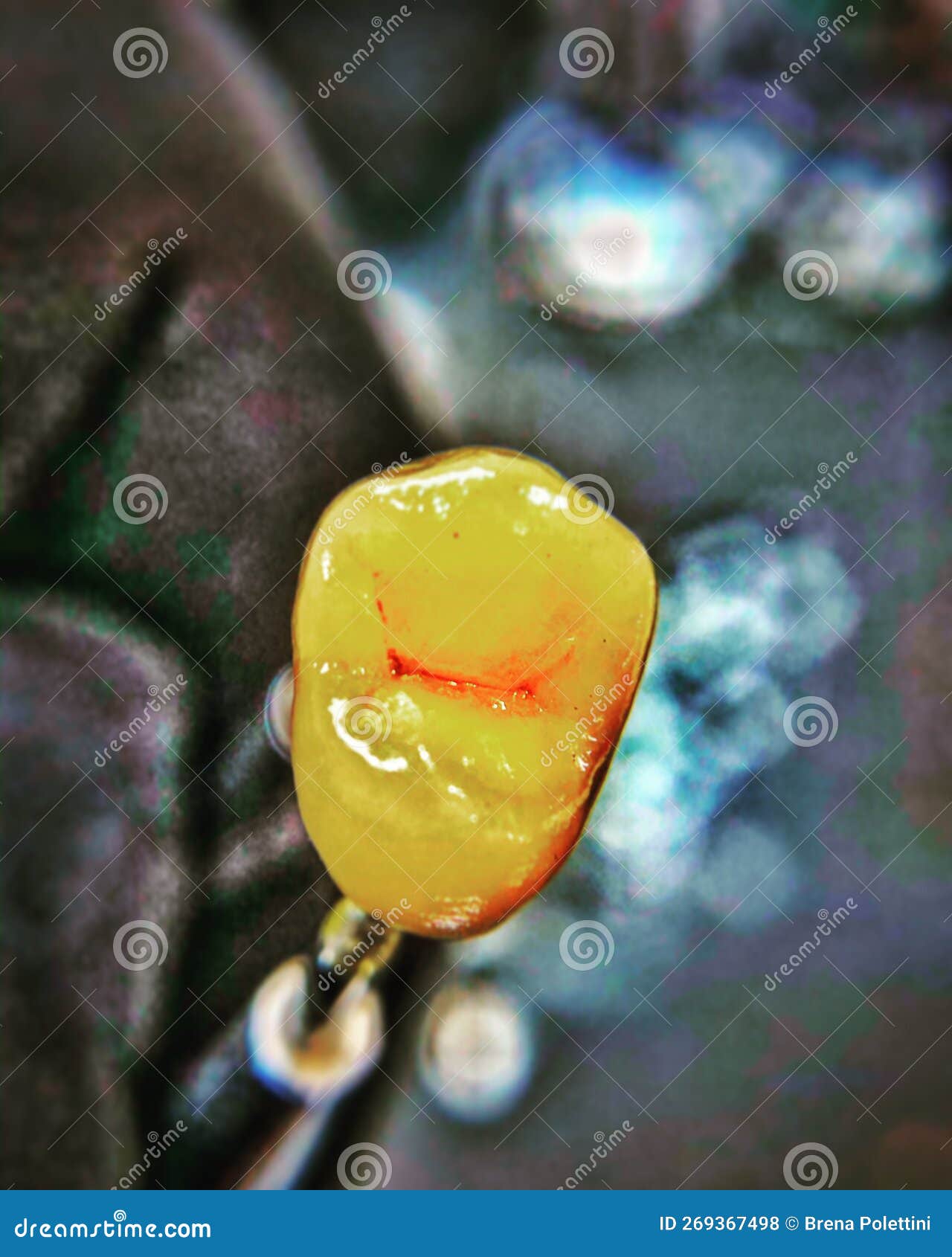 Tooth stock photo. Image of good, filter, tooth, yellow - 269367498