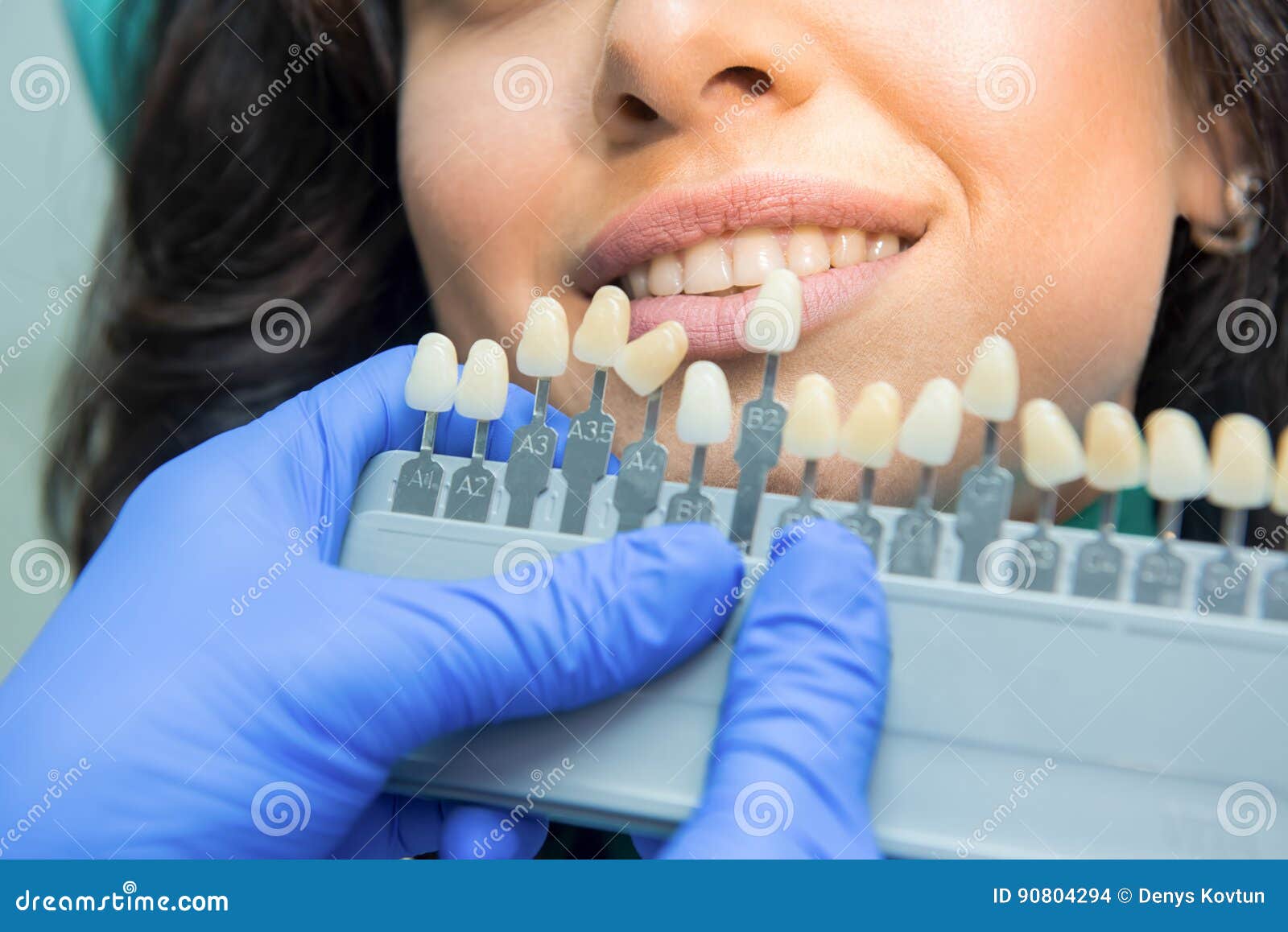 Tooth whitening chart. stock photo. Image of medicine - 90804294