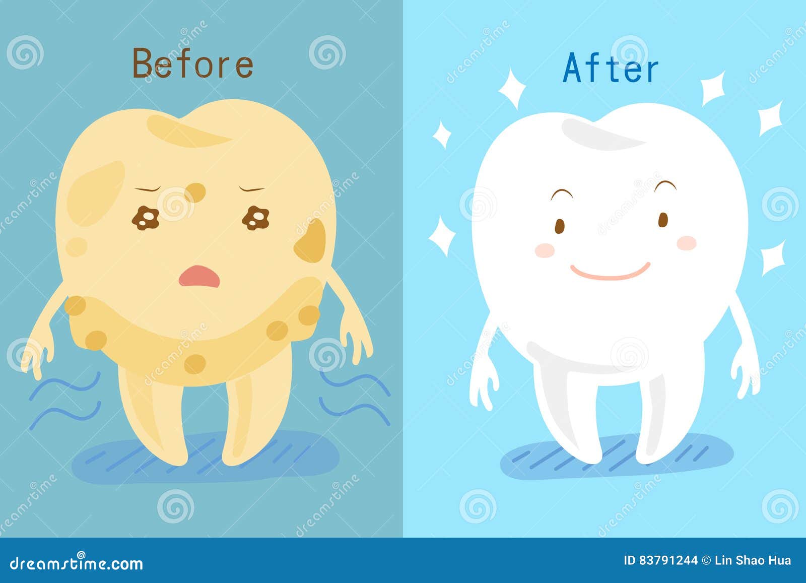 Tooth Whitening before and after Stock Vector - Illustration of color ...