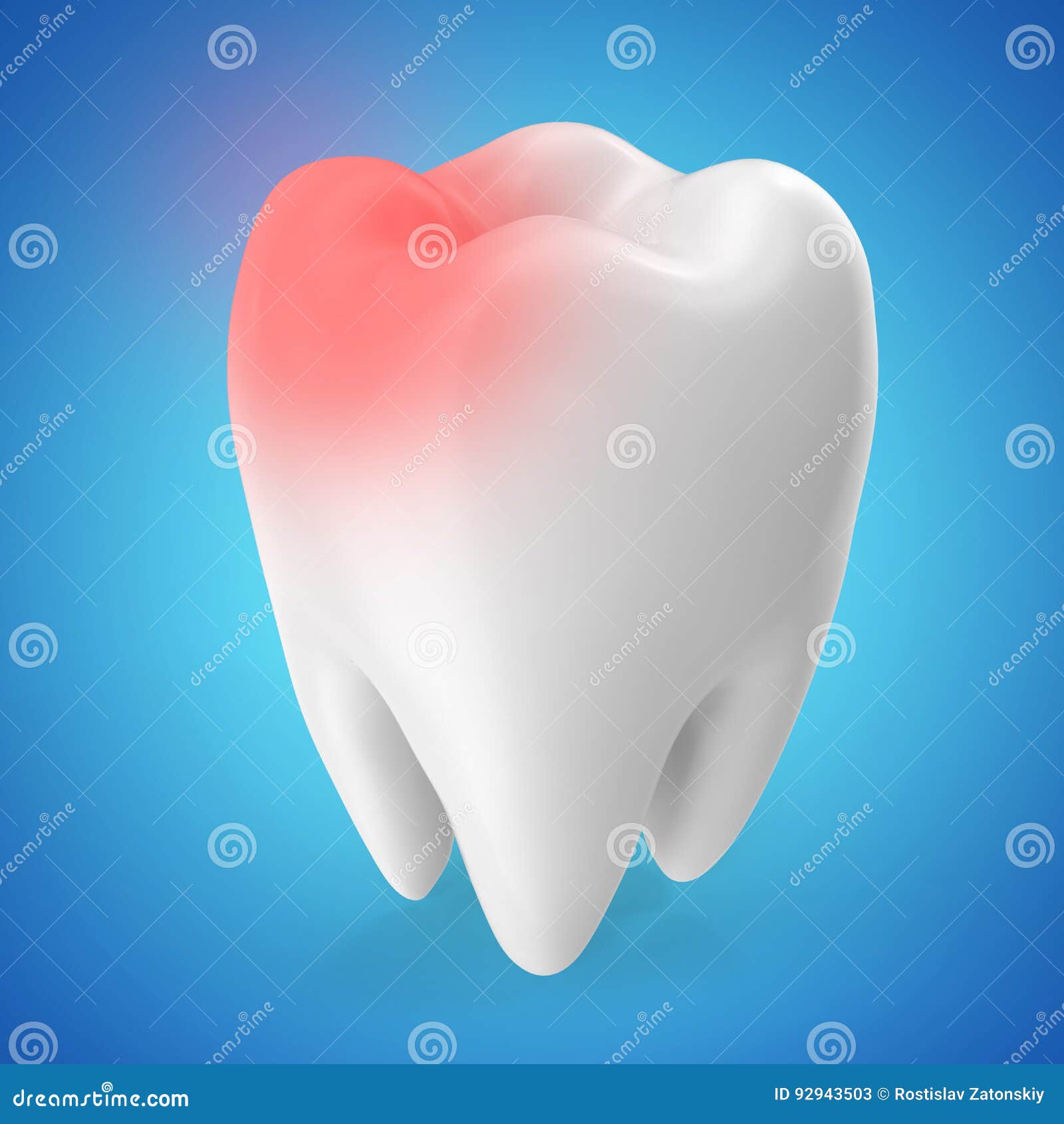 Toothache Concept, Caries Concept Isolated on Blue Tints. 3D Rendering ...