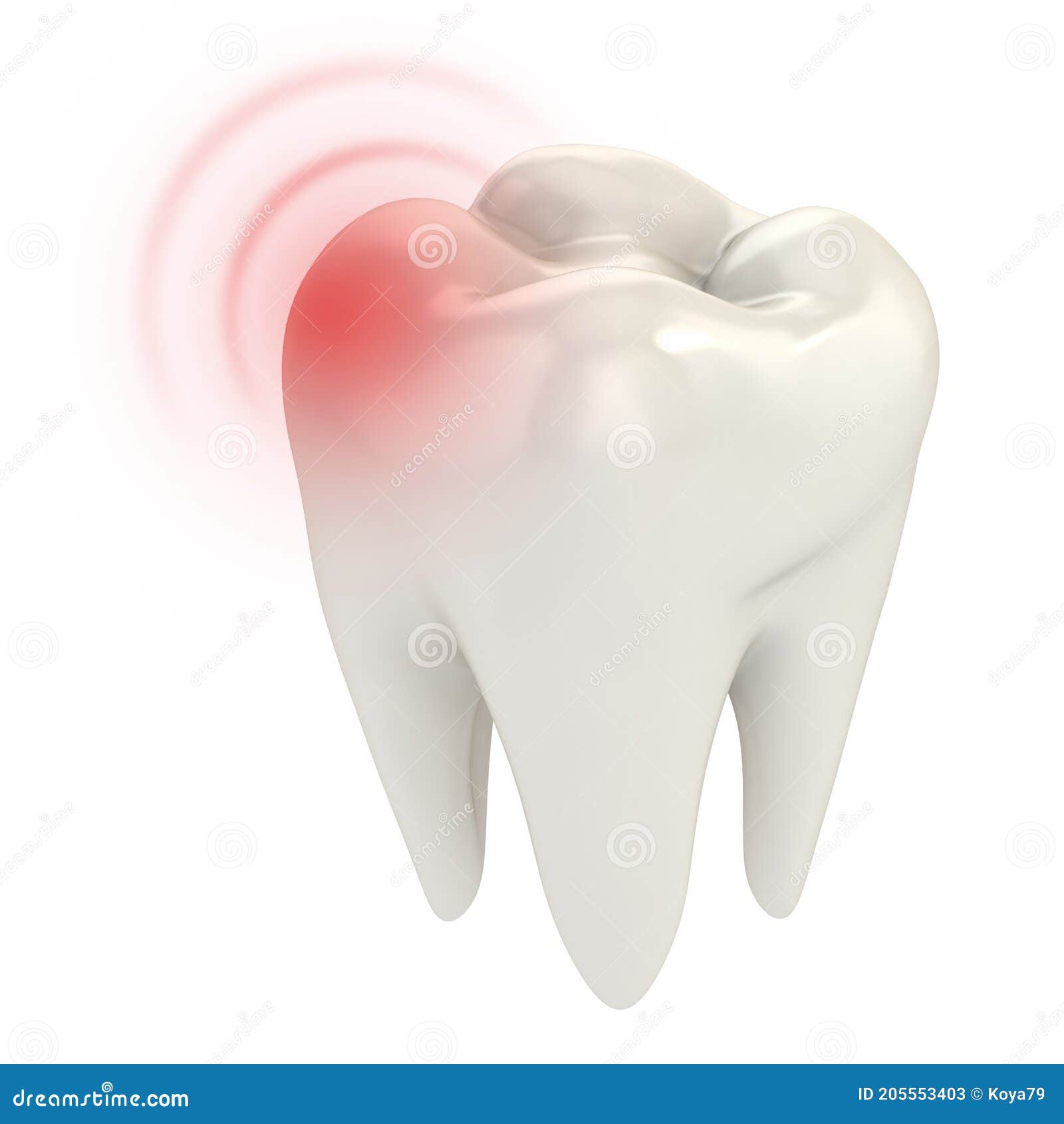 Toothache 3d Concept on White Background Stock Illustration ...