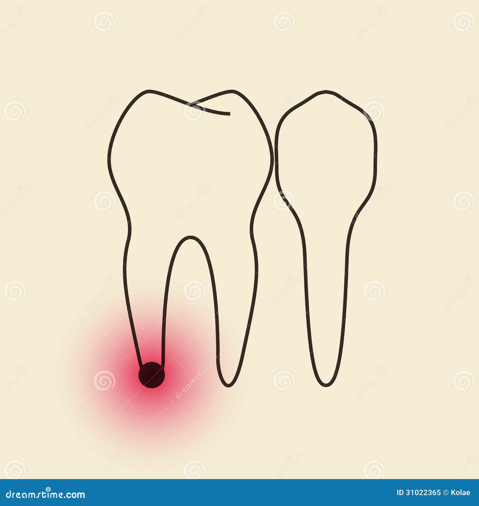 Pulpitis And Healthy Tooth Vector Illustration | CartoonDealer.com ...