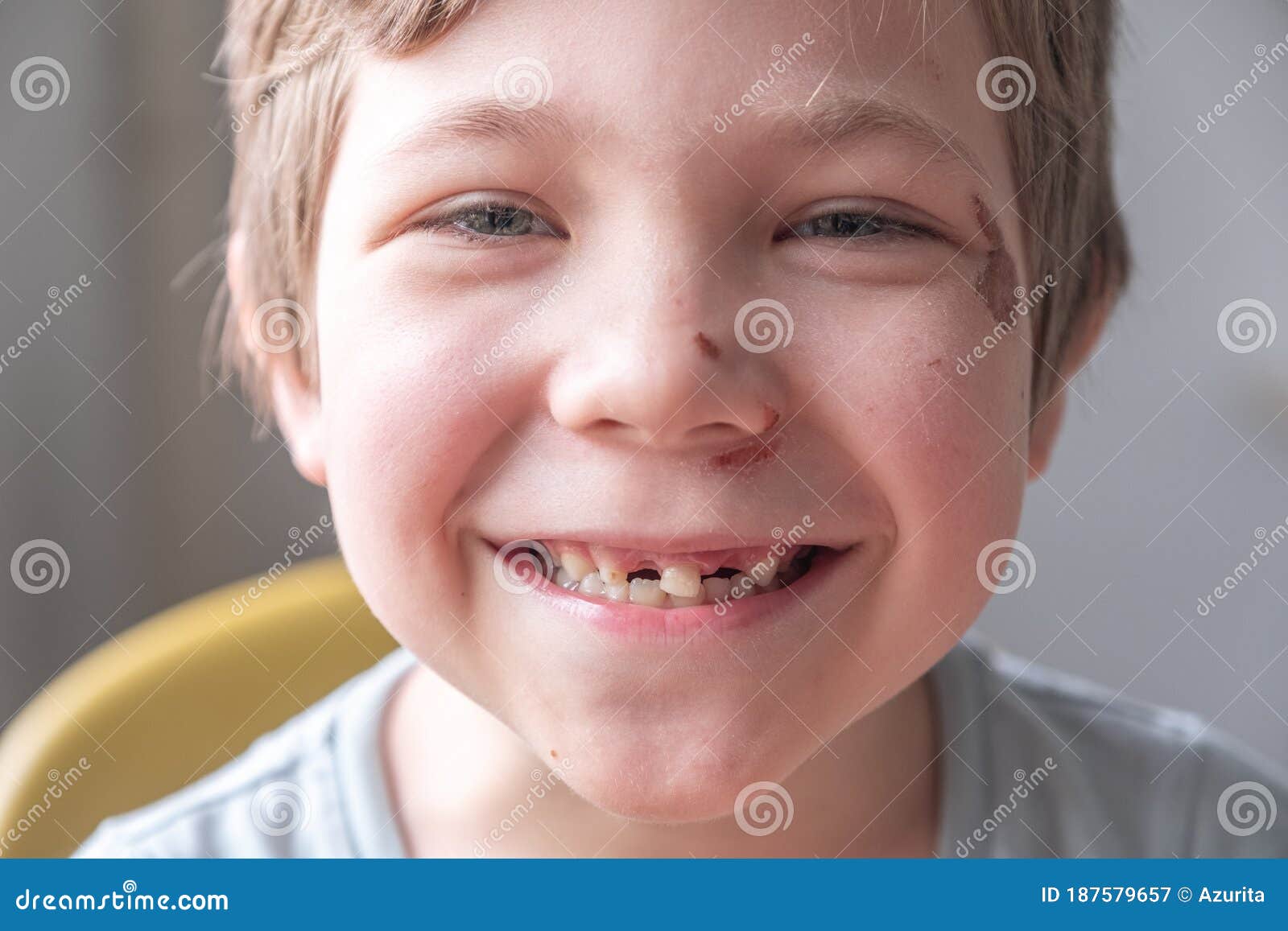Toothless boy smiling stock image. Image of patient - 187579657
