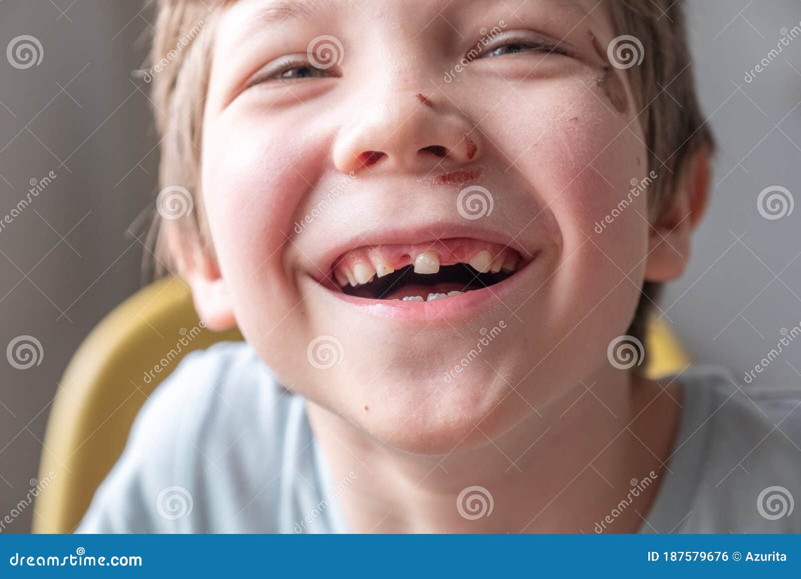 Toothless boy smiling stock photo. Image of remedial - 187579676