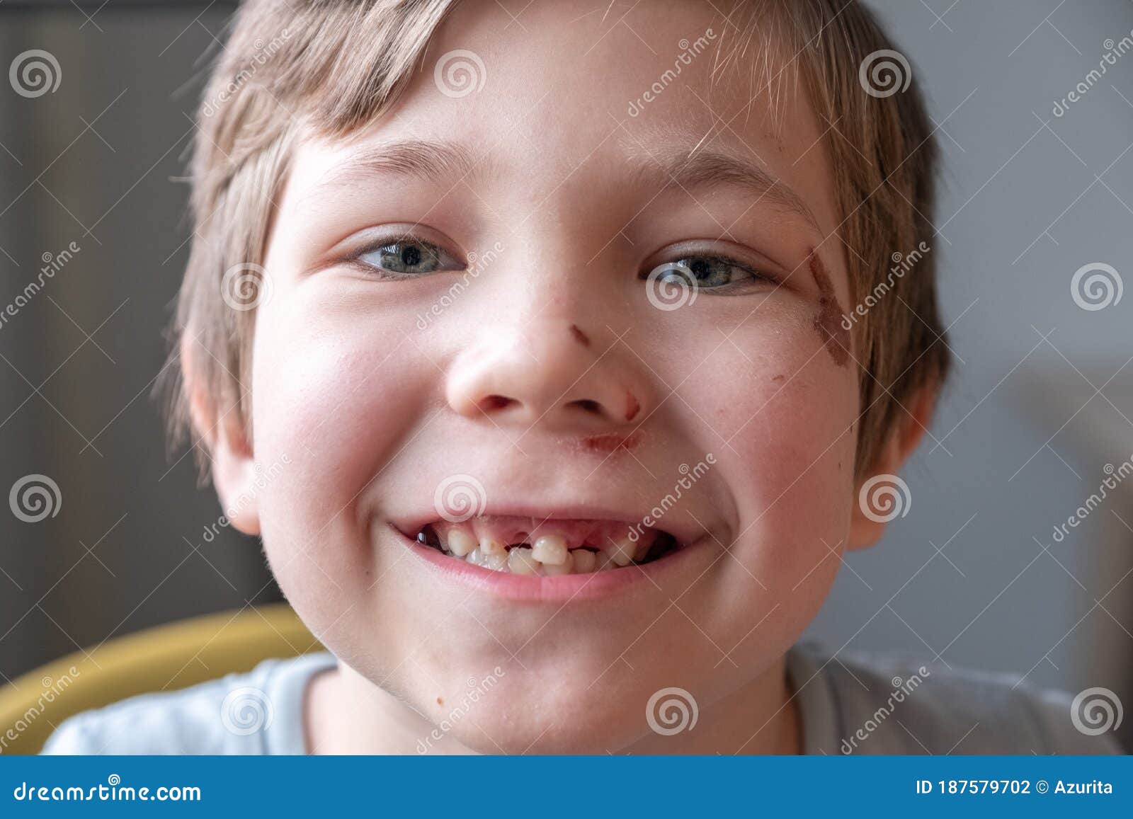 Toothless boy smiling stock photo. Image of remedial - 187579702