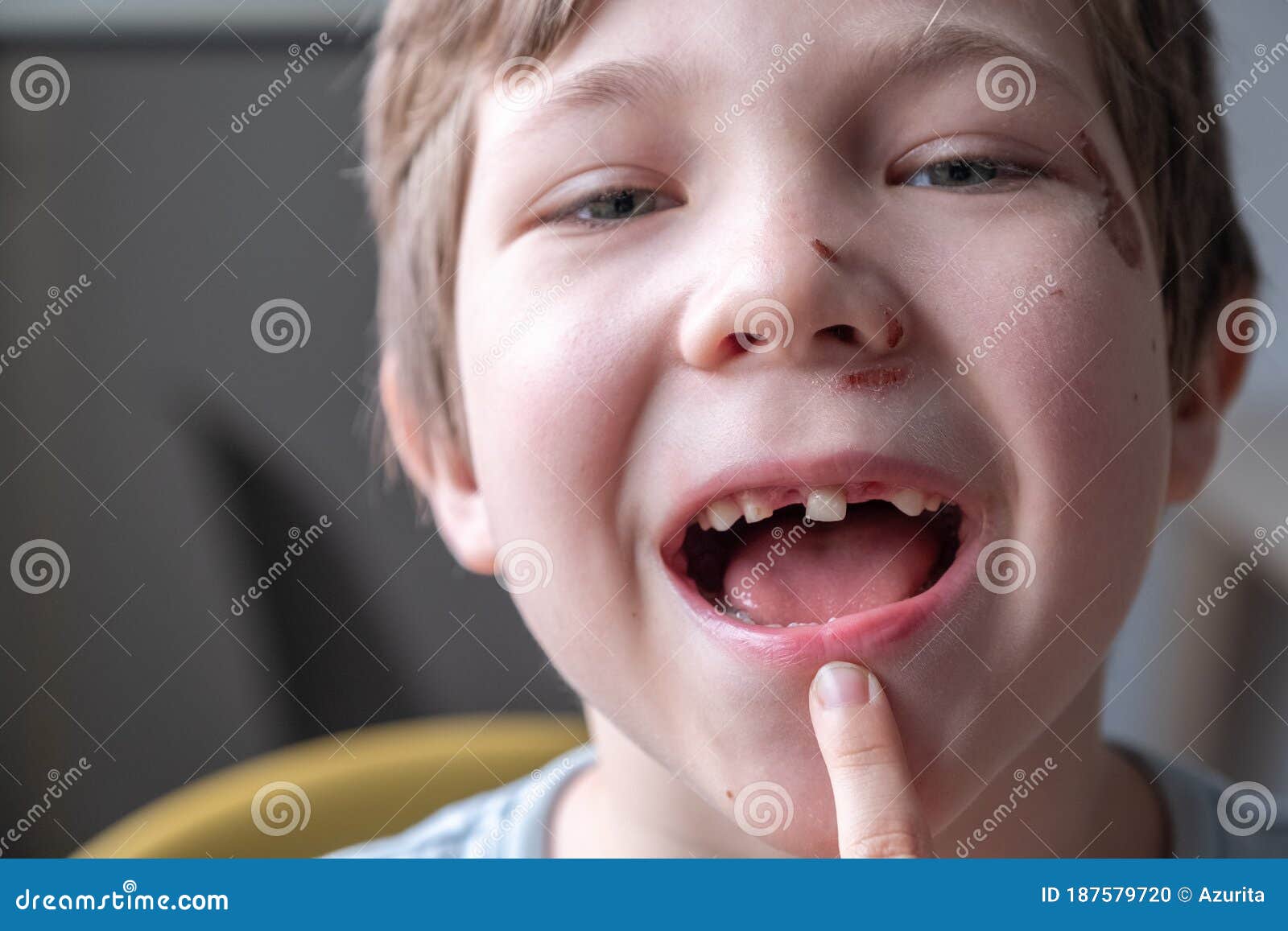 Toothless boy smiling stock photo. Image of childhood - 187579720
