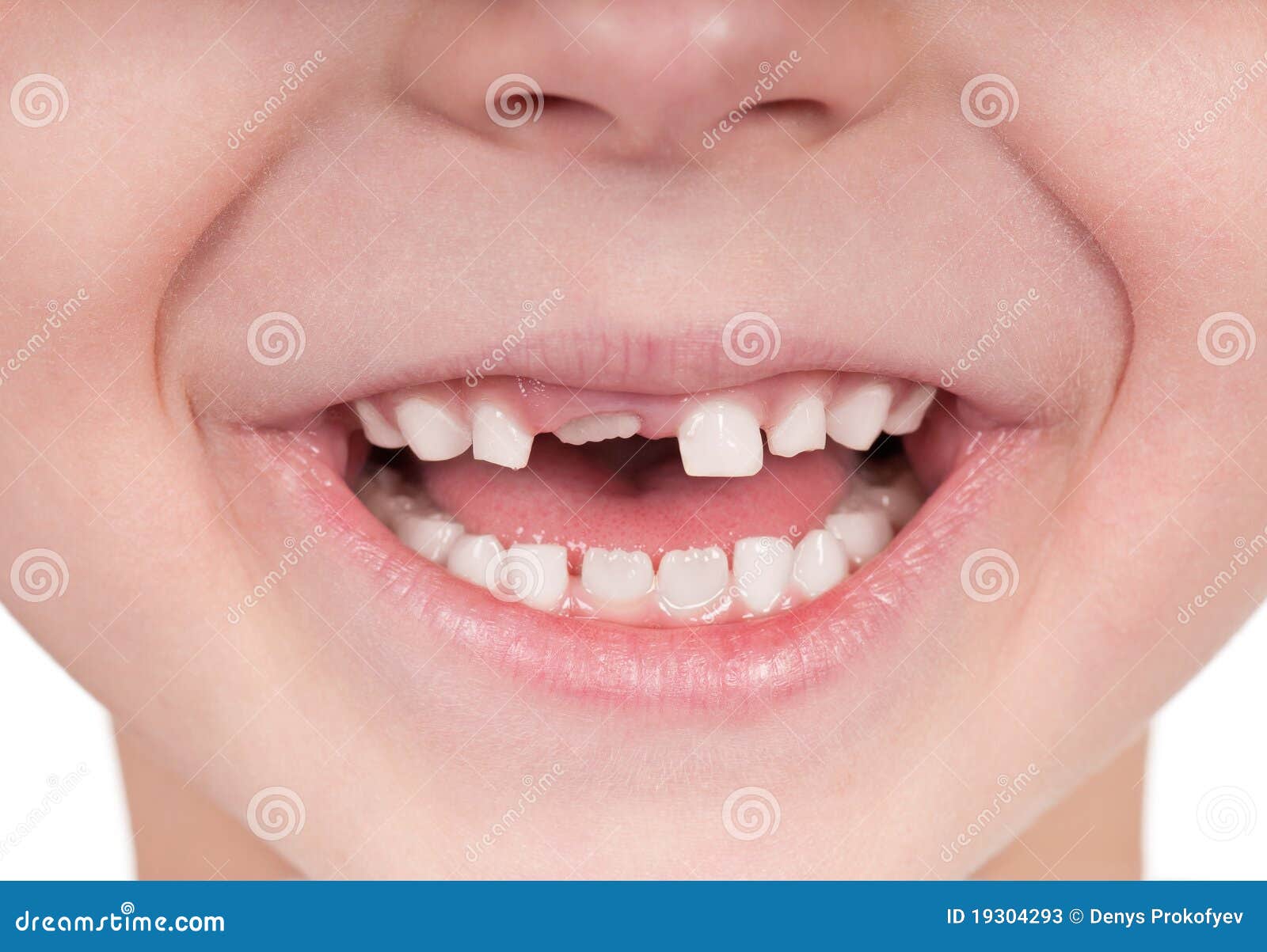 Toothless smile stock image. Image of males, details - 19304293