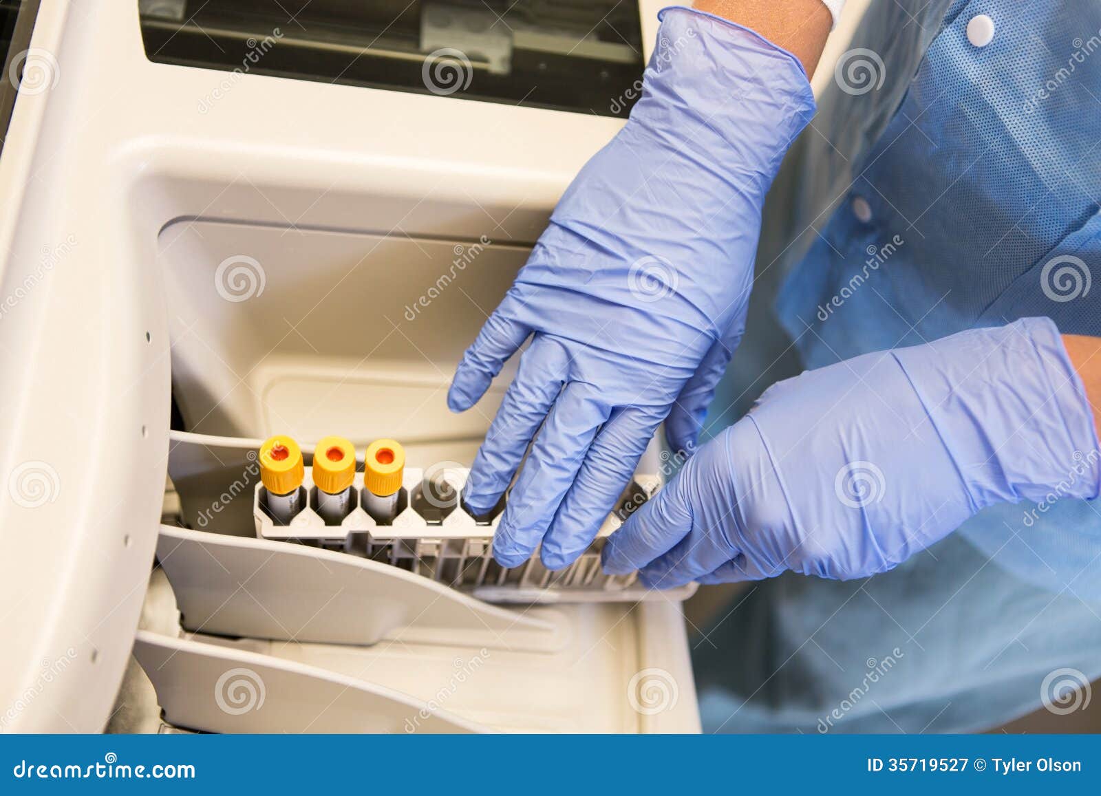 Top View Loading Samples in Chemistry Analyzer Stock Image - Image of ...
