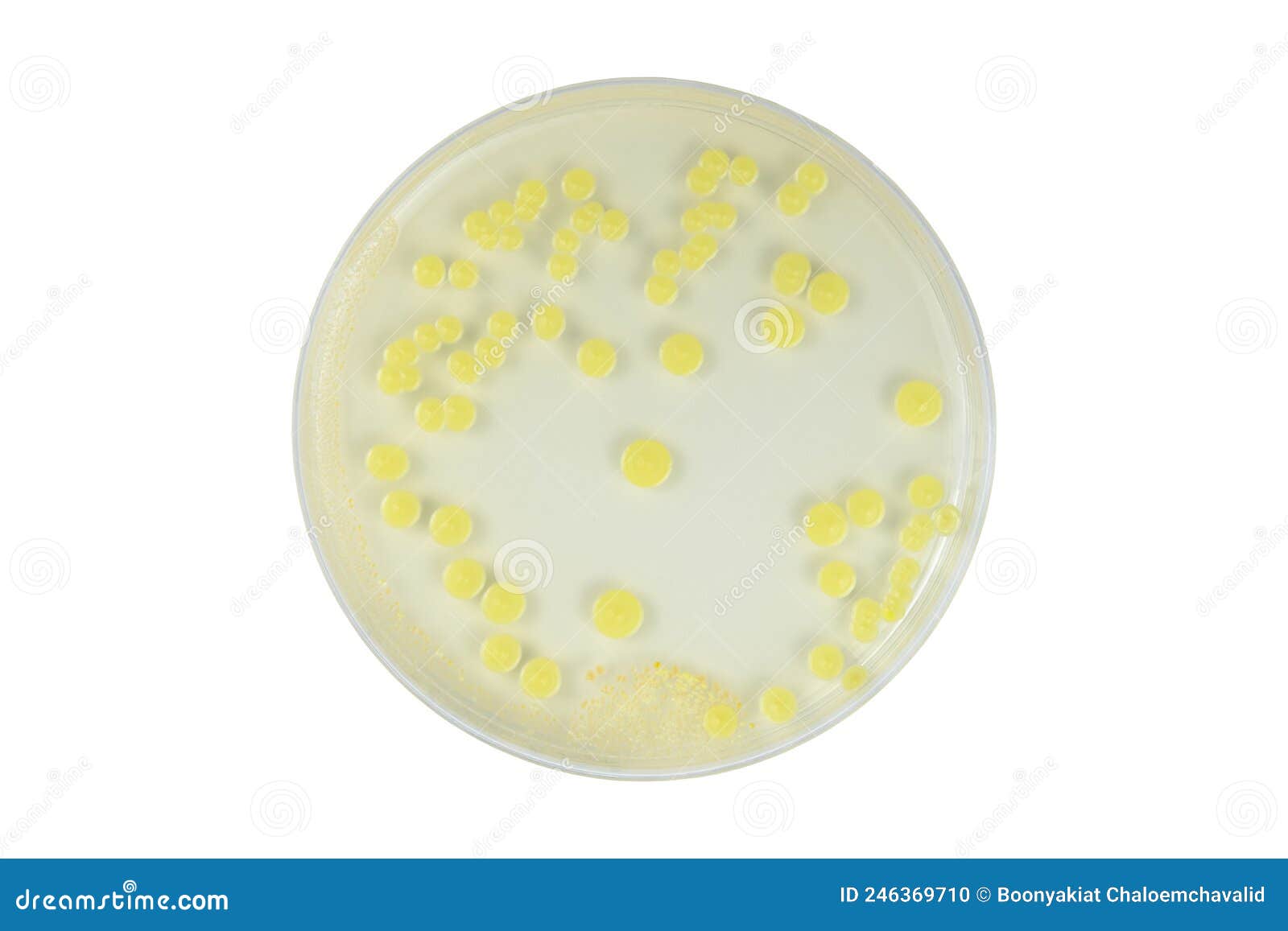 Top View of Petri Dish and Culture Media with Bacteria on White ...