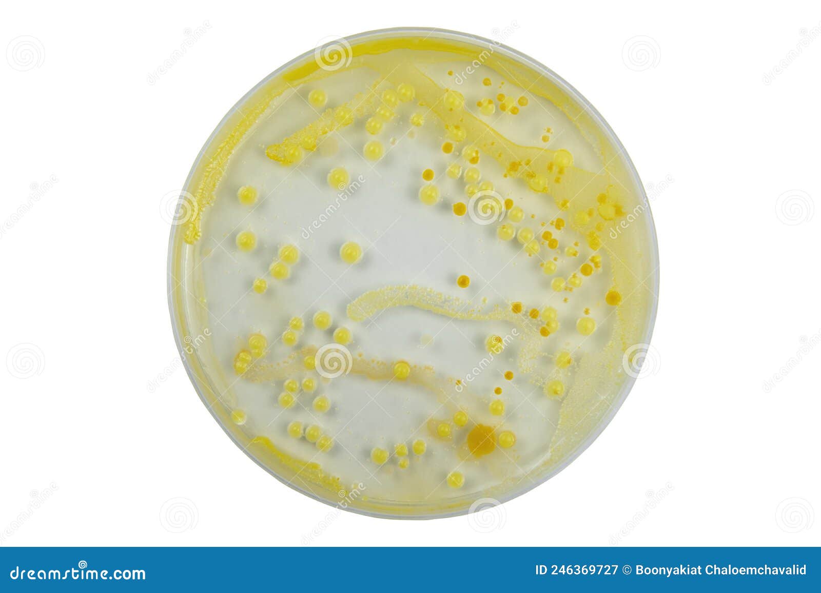 Top View of Petri Dish and Culture Media with Bacteria on White ...