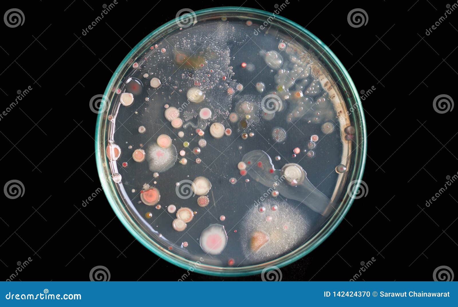 Top View Soil Microorganisms Nutrient Agar in Plate on Black Background ...