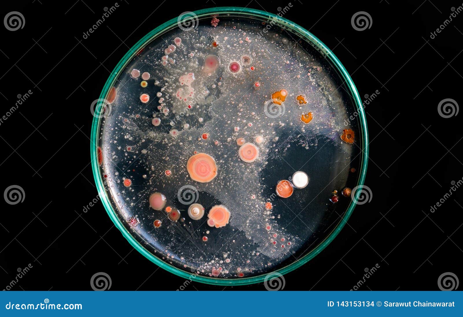 Top View Soil Microorganisms Nutrient Agar in Plate on Black Background ...