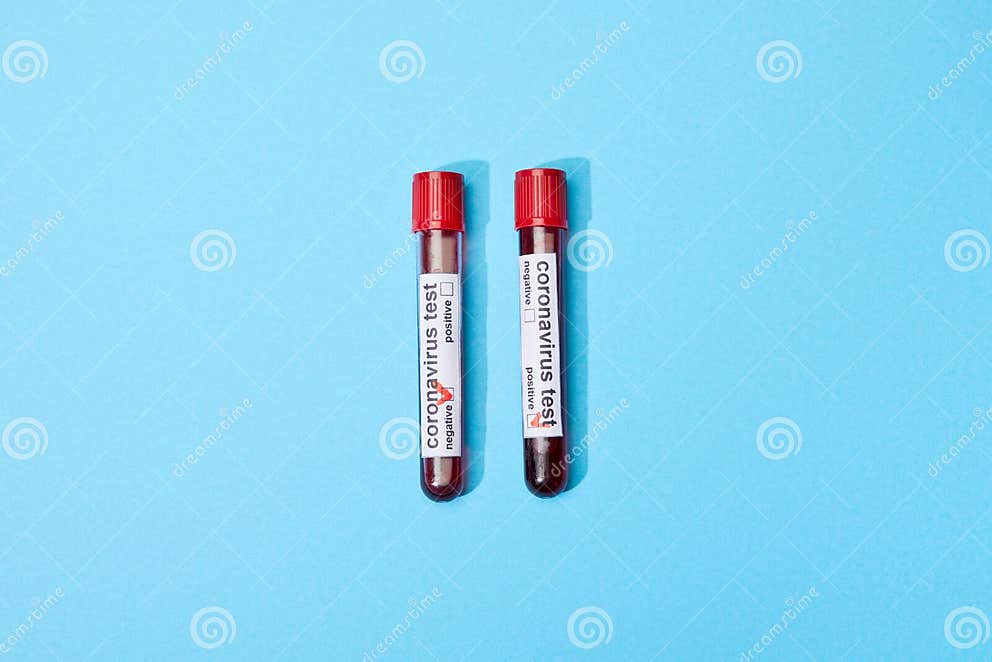 Top View of Test Tubes with Samples and Coronavirus Test Lettering ...