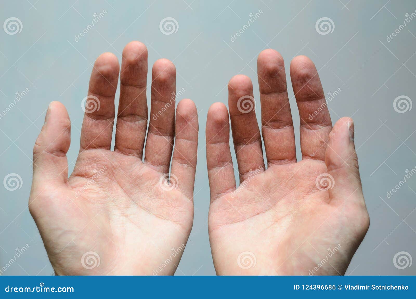 Top View of Two Empty Hands Stock Photo - Image of human, mump: 124396686