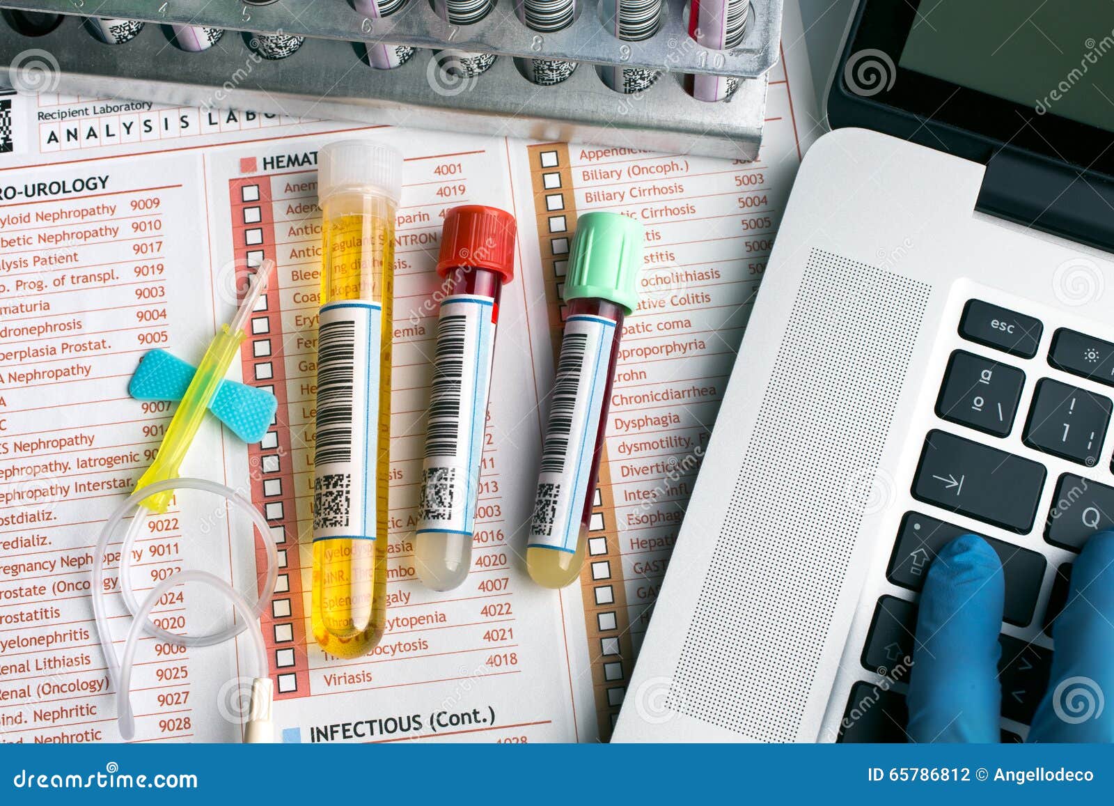 Top View of a Work Table of Lab with Test Tubes for Analysis and Stock ...