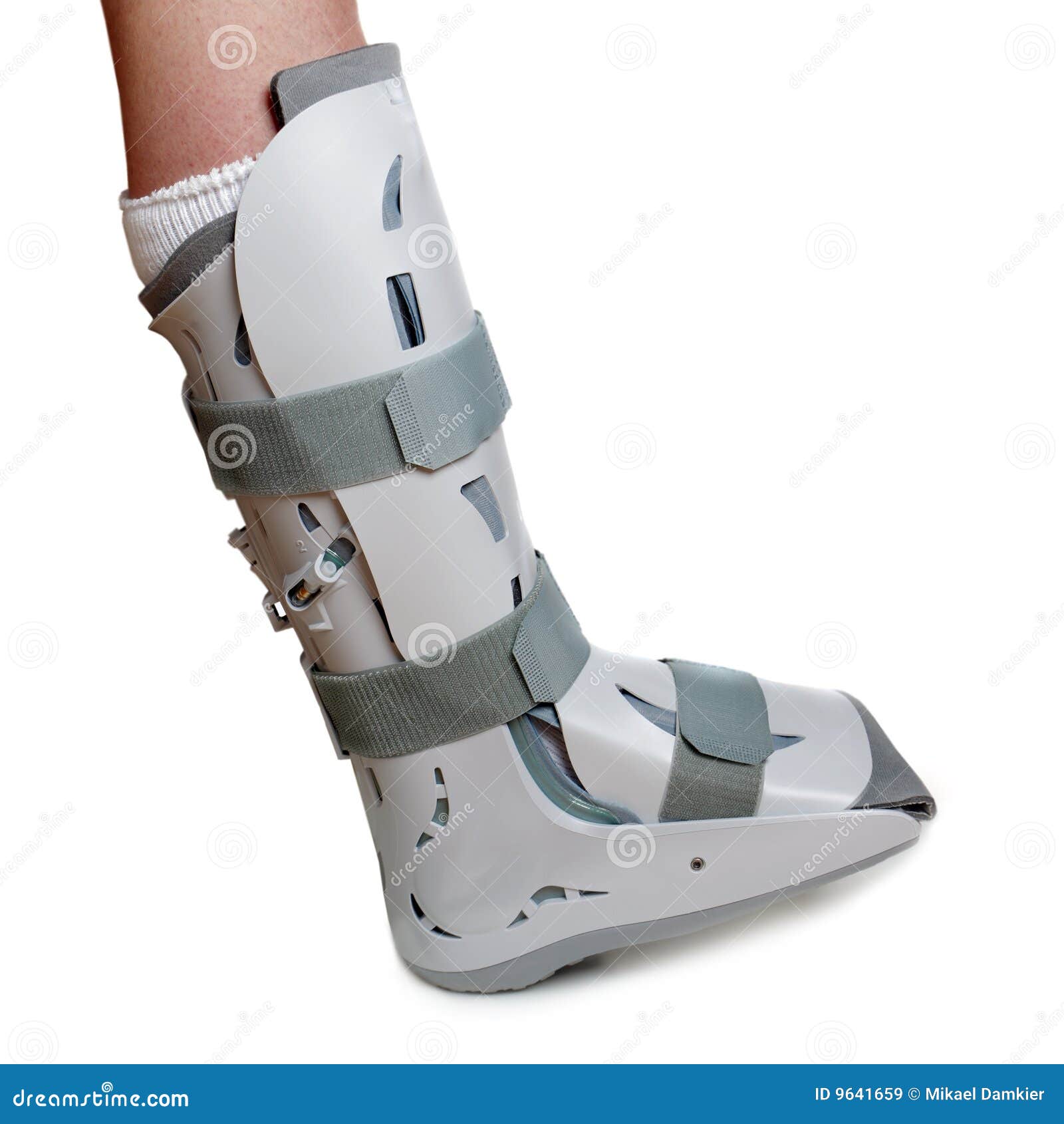 Torcedura Severa Do Tornozelo Imagem de Stock - Imagem de acidente ...