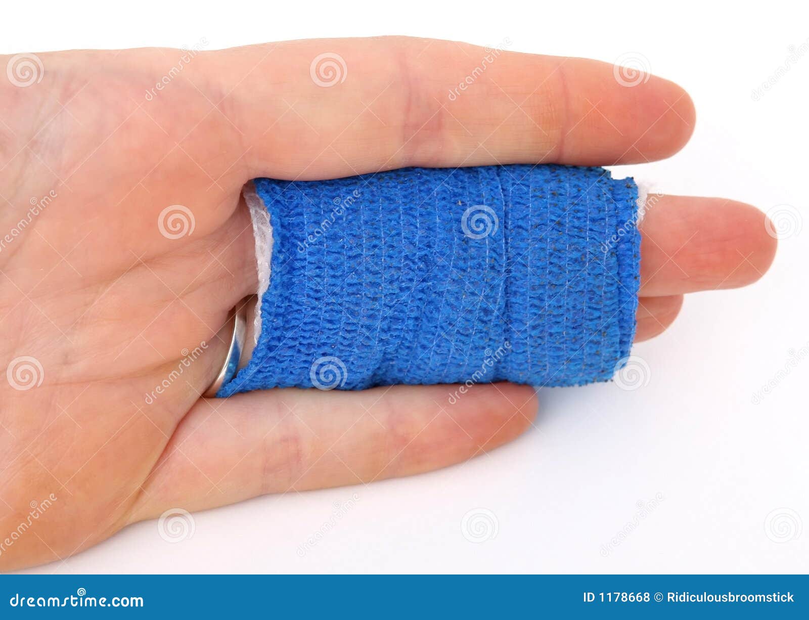 The Scar On The Leg. Bone Fracture Or Tumor Removal. Recobvery ...