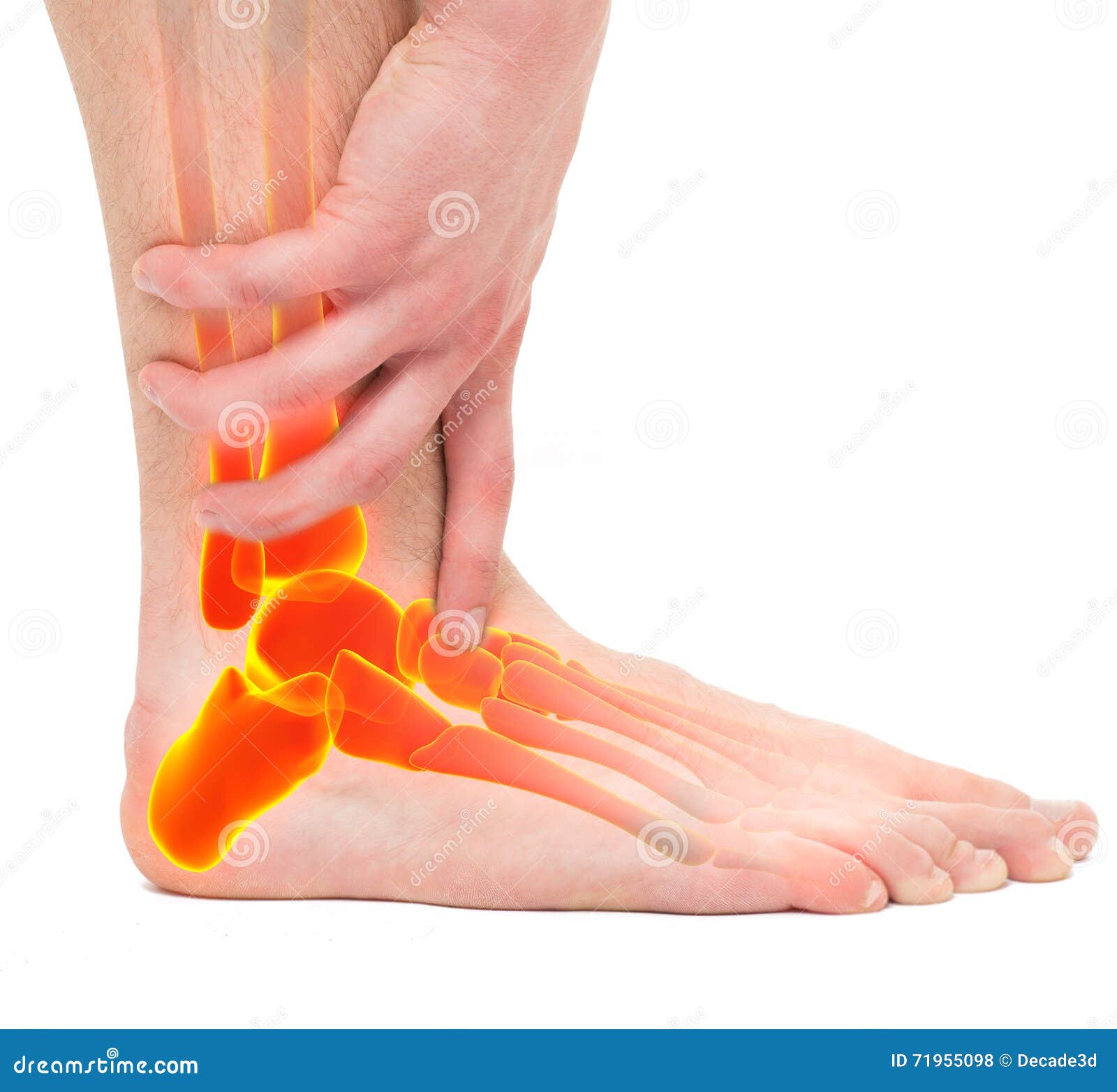 Tornozelo Torcido - Equipe Guardar O Tornozelo - Anatomia Masculina ...