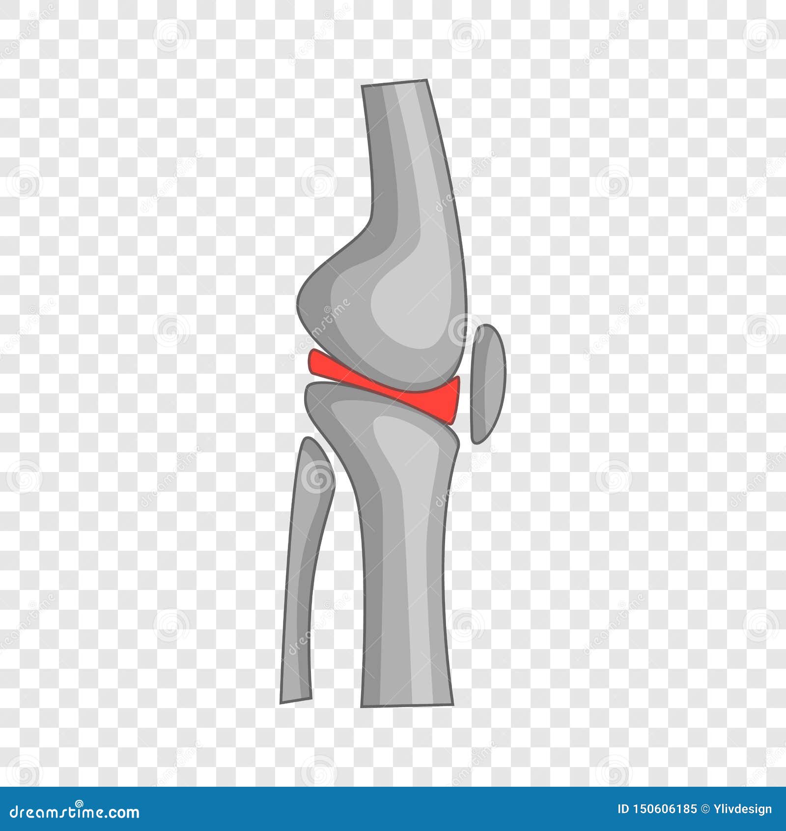 Total Knee Replacement Surgery Icon, Cartoon Style Vector Illustration ...