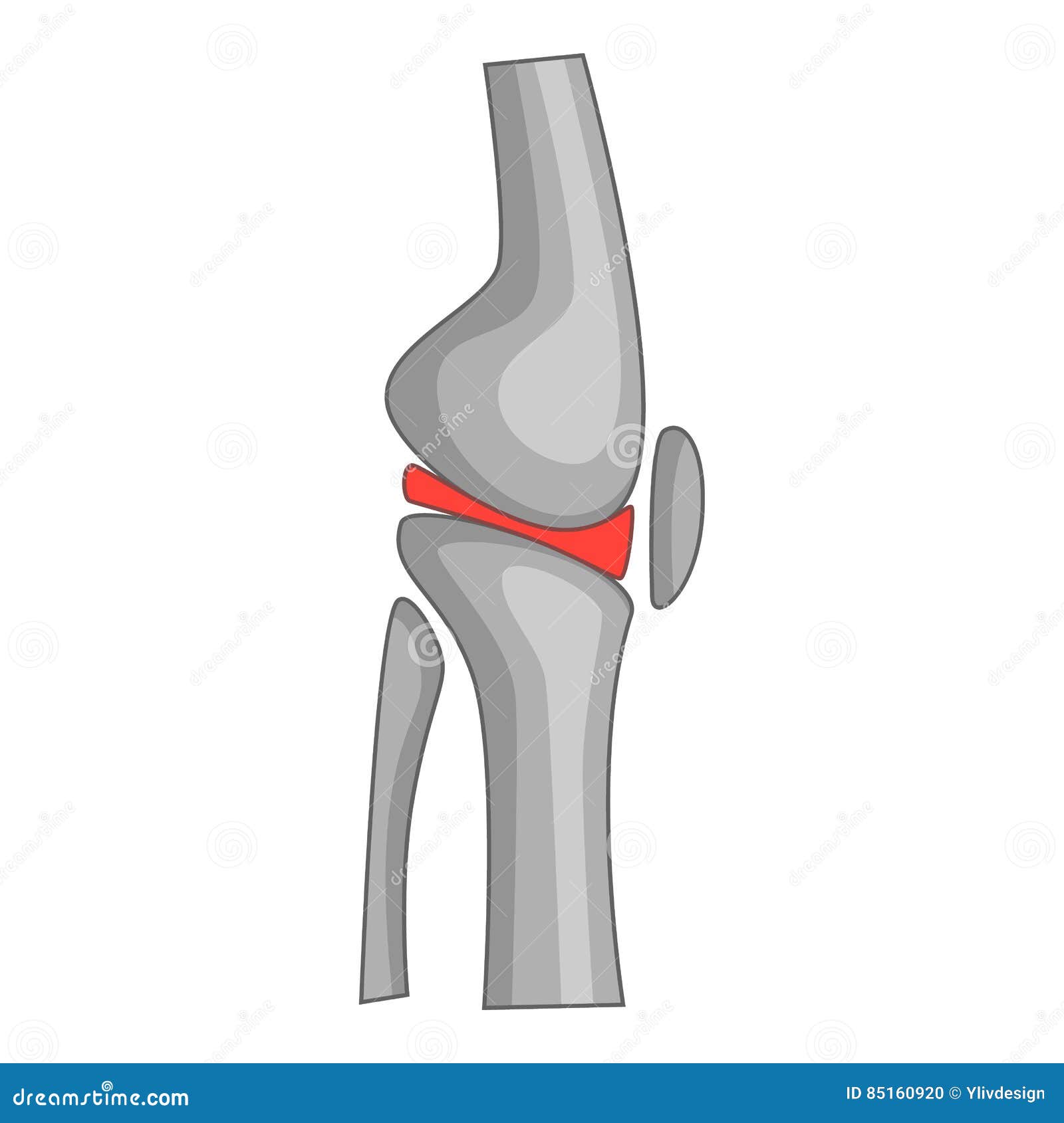 Total Knee Replacement Surgery Icon, Cartoon Style Vector Illustration ...
