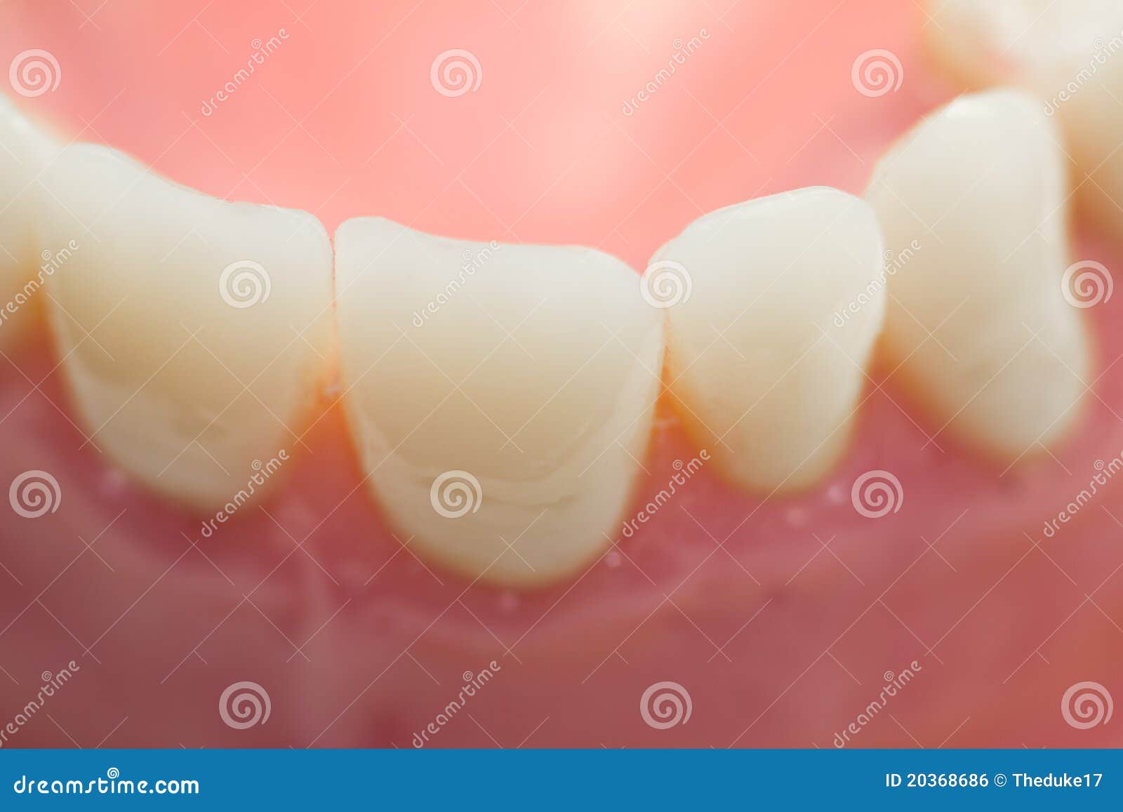 Total prosthesis stock photo. Image of bite, orthodontic - 20368686