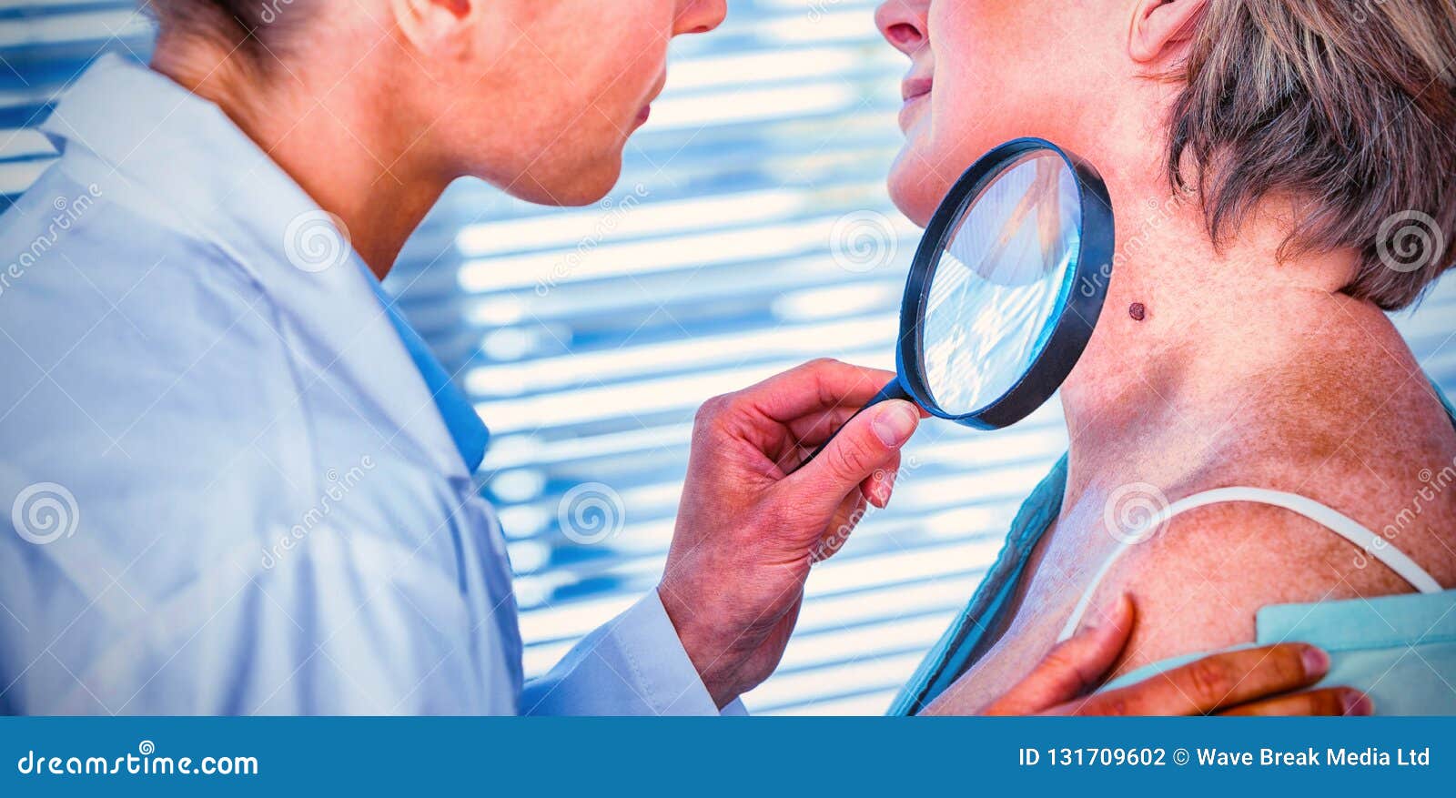 Toupeira De Exame Do Dermatologista Com Lupa Foto de Stock - Imagem de ...