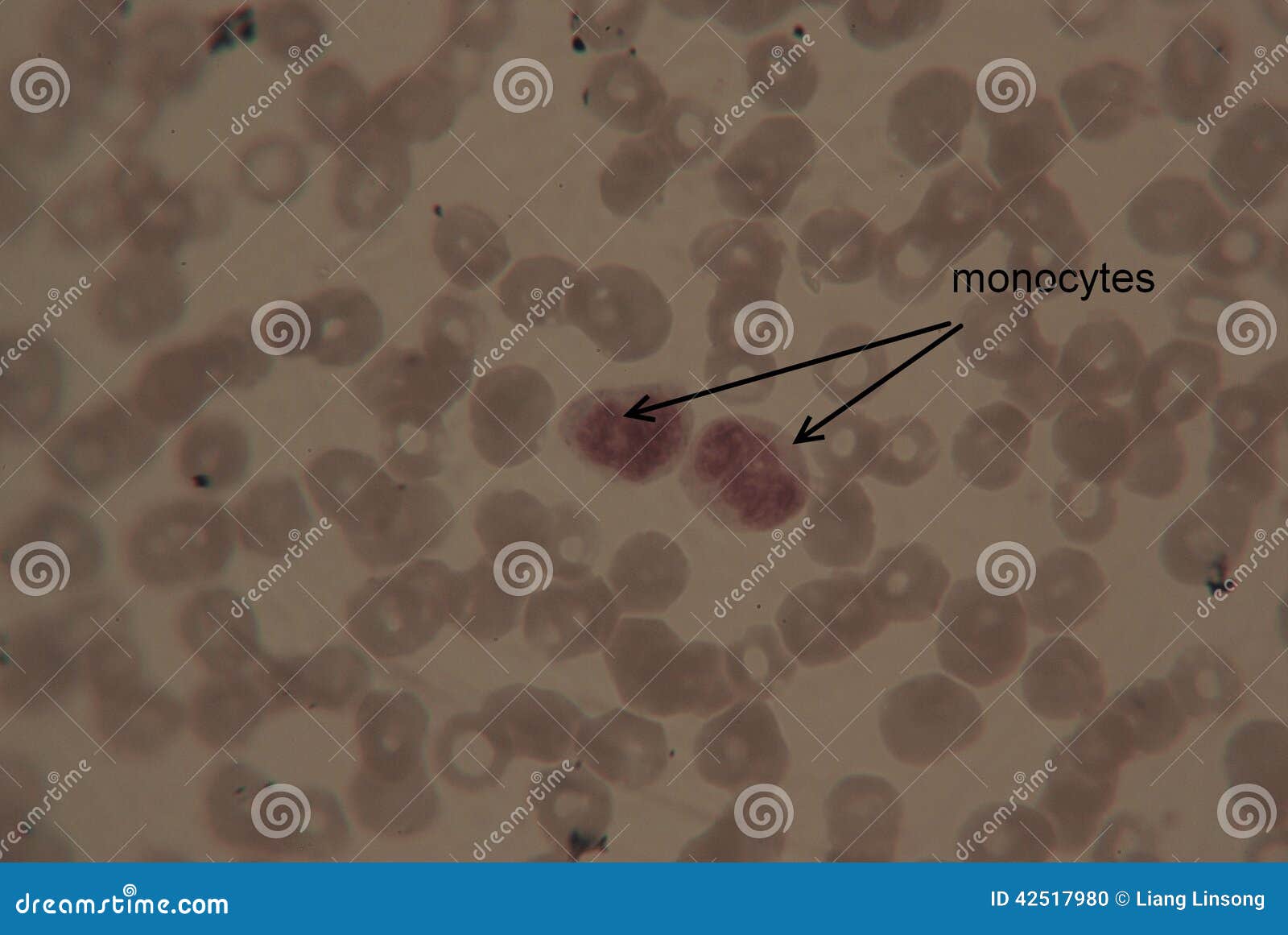 Monocytes stock photo. Image of healthcare, deoxygenated - 42517980