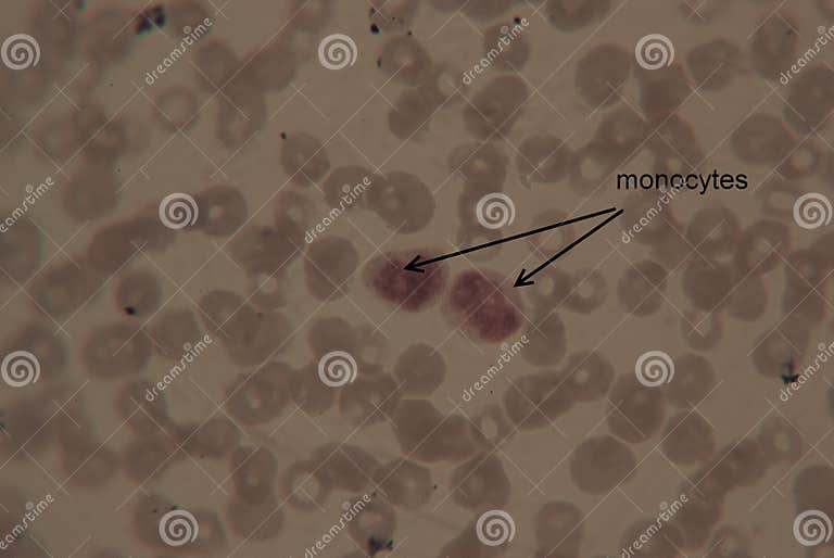 Monocytes stock photo. Image of healthcare, deoxygenated - 42517980