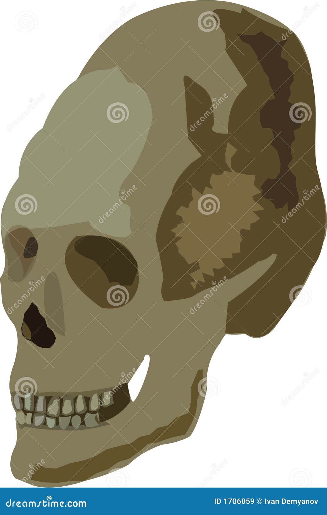 Tower Skull Picture. Image: 1706059