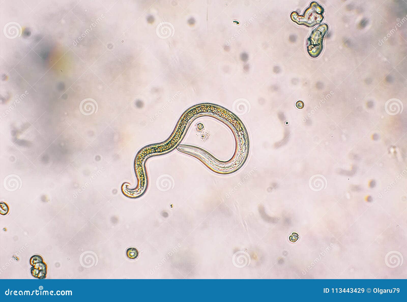 Two Eggs Of Toxocara Cati And Two Oocysts Of Isospora Felis Under The ...