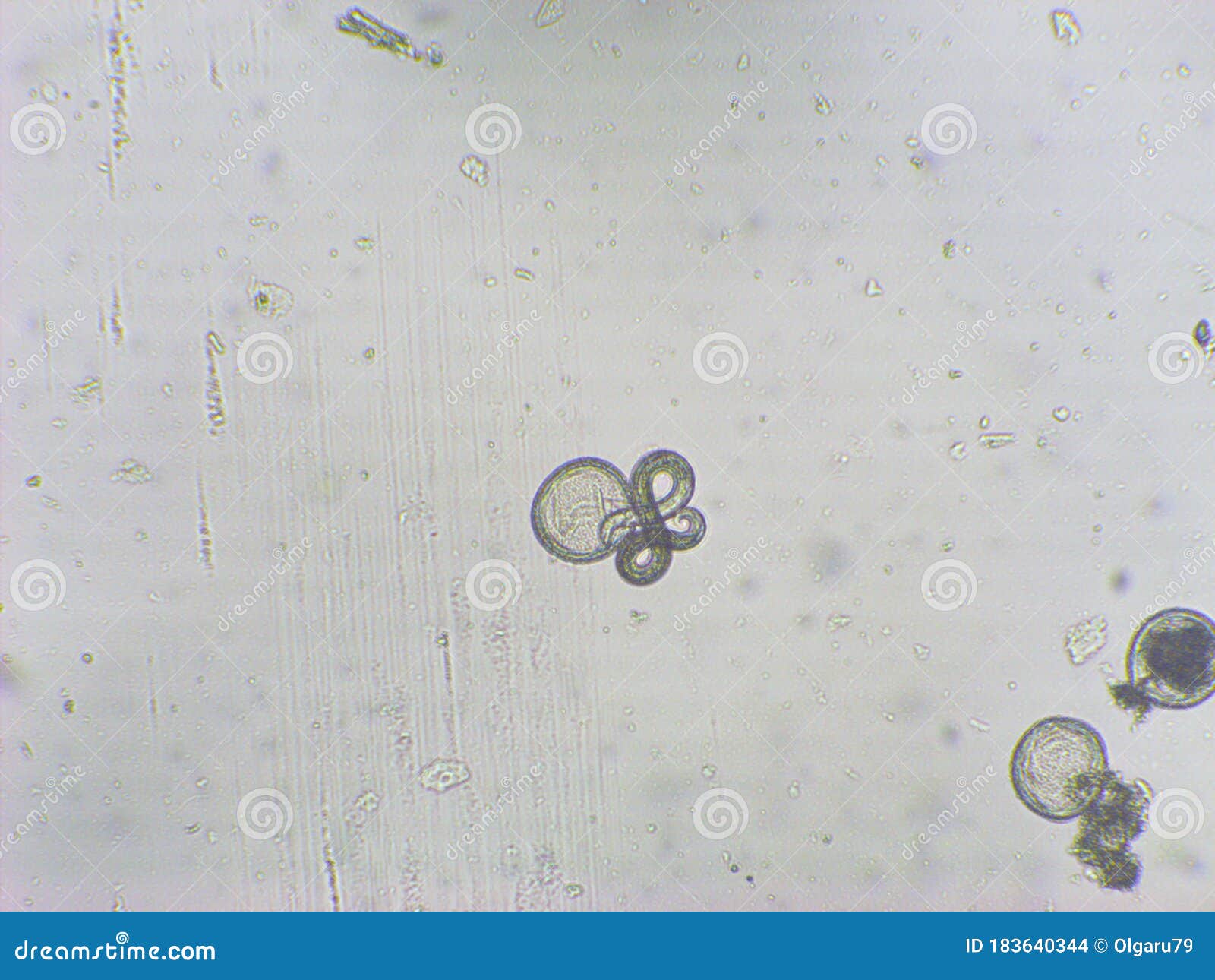 Two Eggs Of Toxocara Cati And Two Oocysts Of Isospora Felis Under The ...