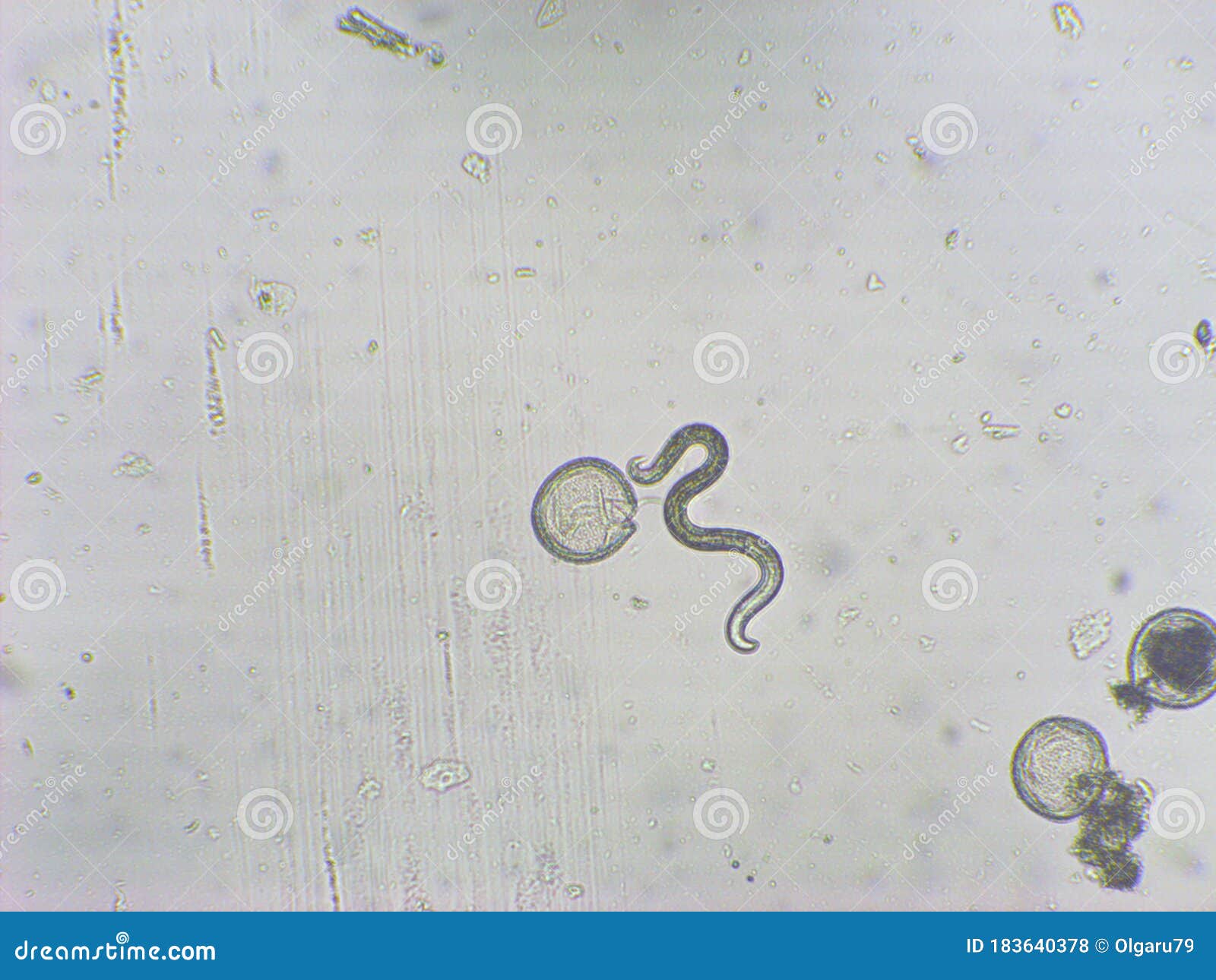 Toxocara Canis Second Stage Larvae Hatch from Eggs Stock Photo - Image ...