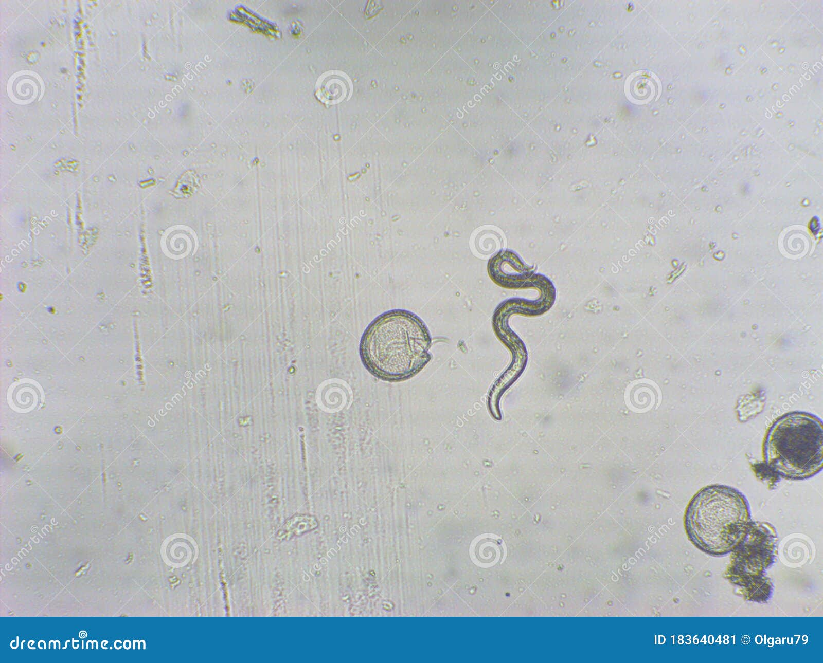 Toxocara Canis Second Stage Larvae Hatch from Eggs Stock Image - Image ...