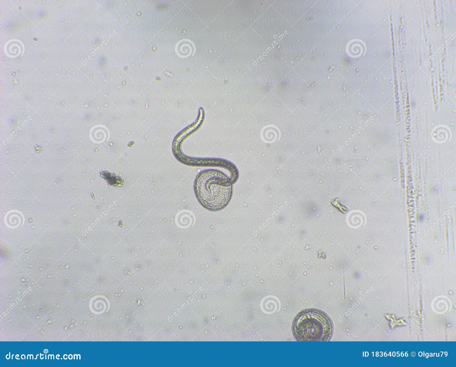 Two Eggs Of Toxocara Cati And Two Oocysts Of Isospora Felis Under The ...