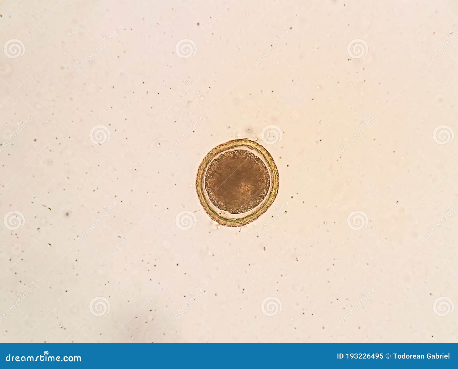 Toxocara Cati Egg Under the Microscope Stock Image - Image of toxocara ...
