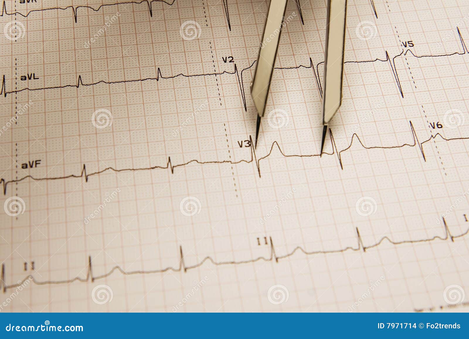 Tracciato di ECG fotografia stock. Immagine di apparecchiatura - 7971714
