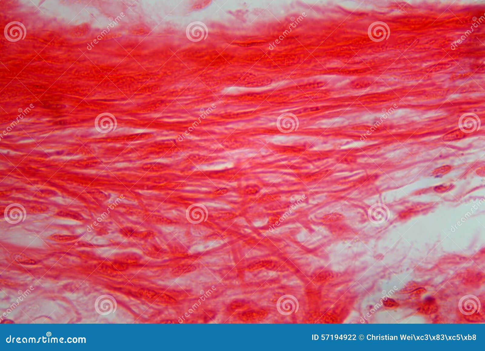Trachea Cells Under the Microscope Stock Photo - Image of airway ...