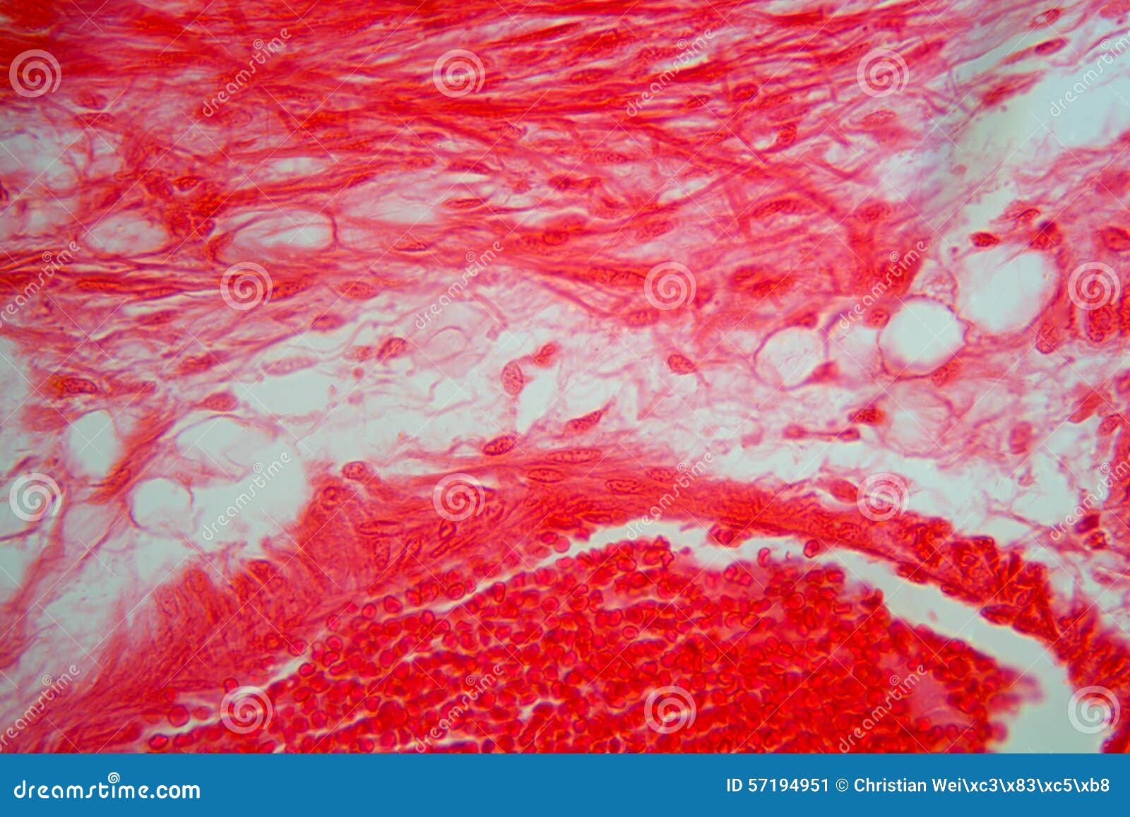 Trachea Cells Under the Microscope Stock Image - Image of micro, cancer ...