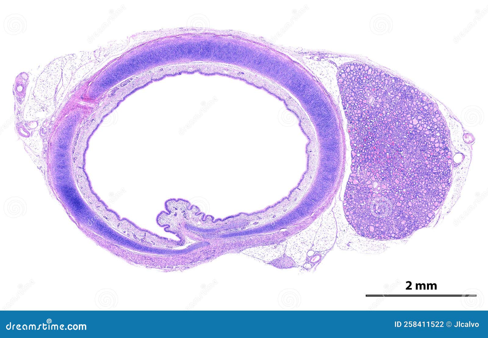 Trachea and thyroid stock photo. Image of rings, microscopy - 258411522