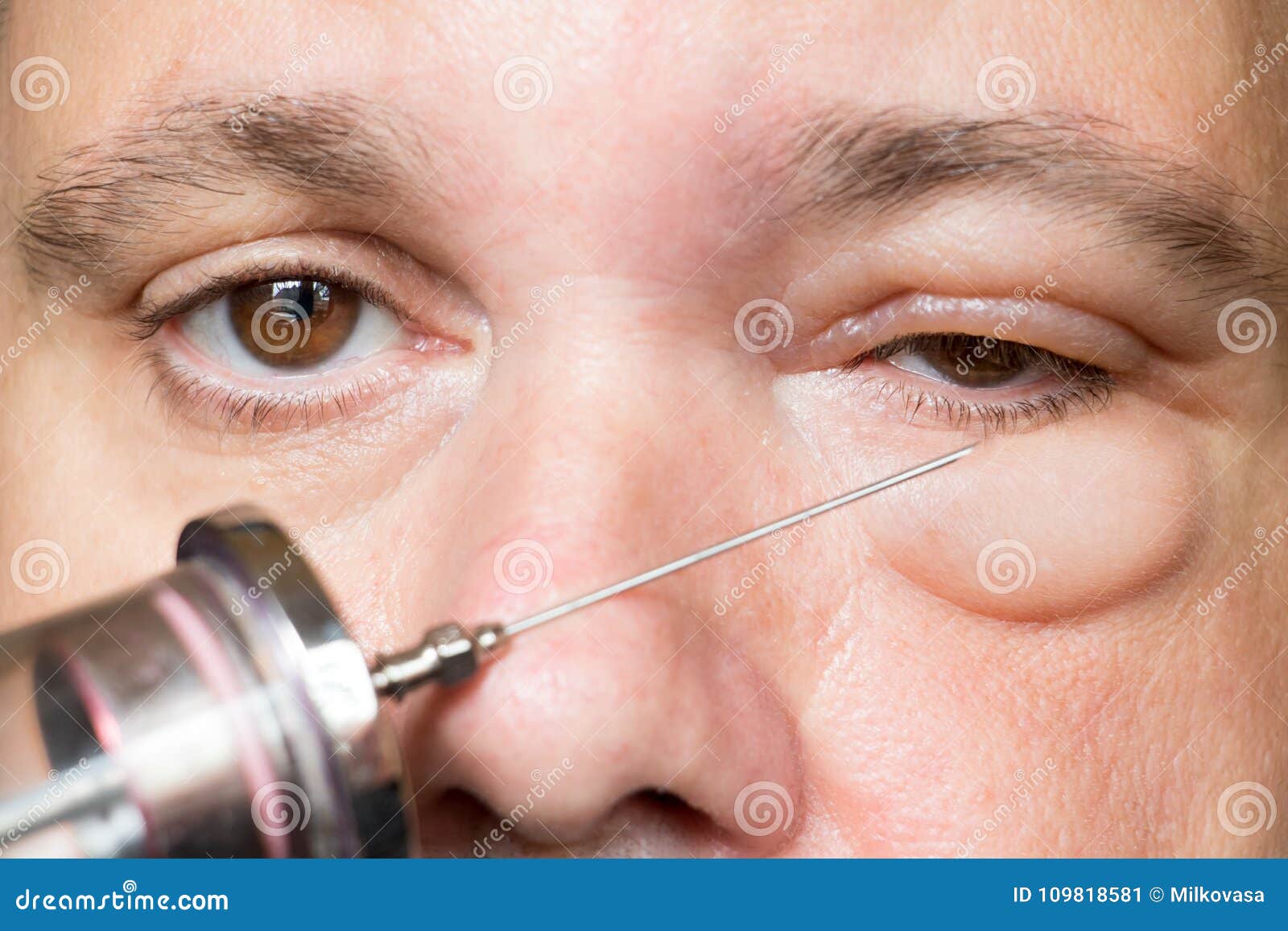 Traitement De L'oeil Malade Image stock - Image du docteur ...