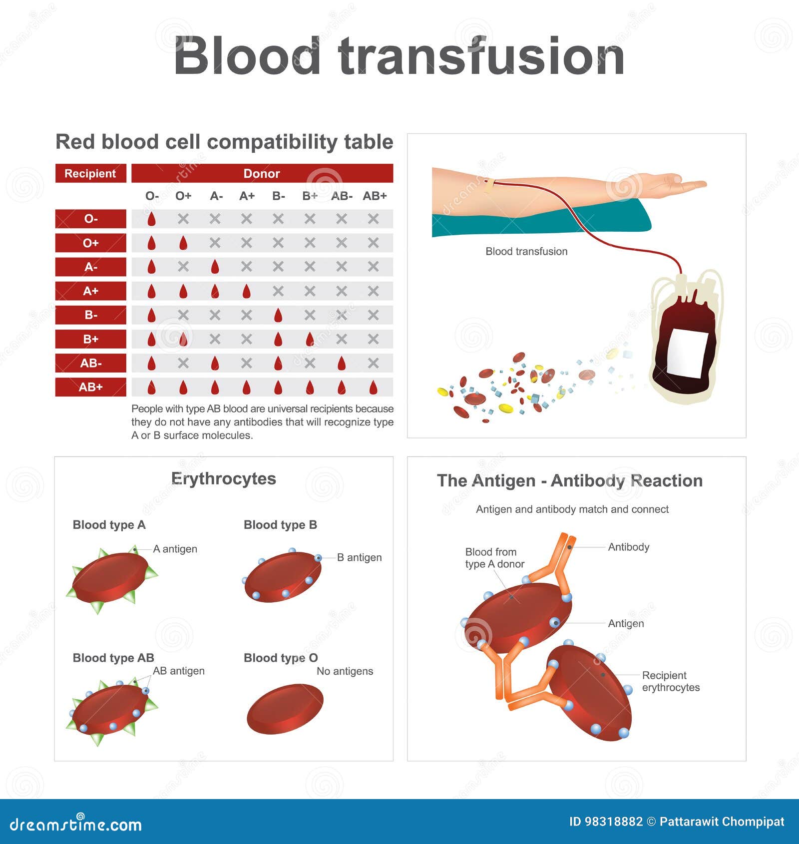 Transfusión de sangre ilustración del vector. Ilustración de hospital ...