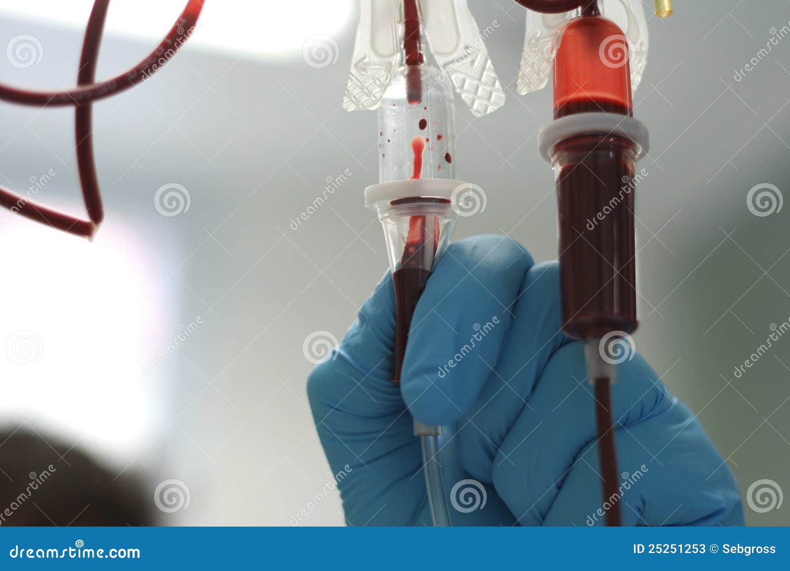 Transfusion blood stock image. Image of process, life - 25251253